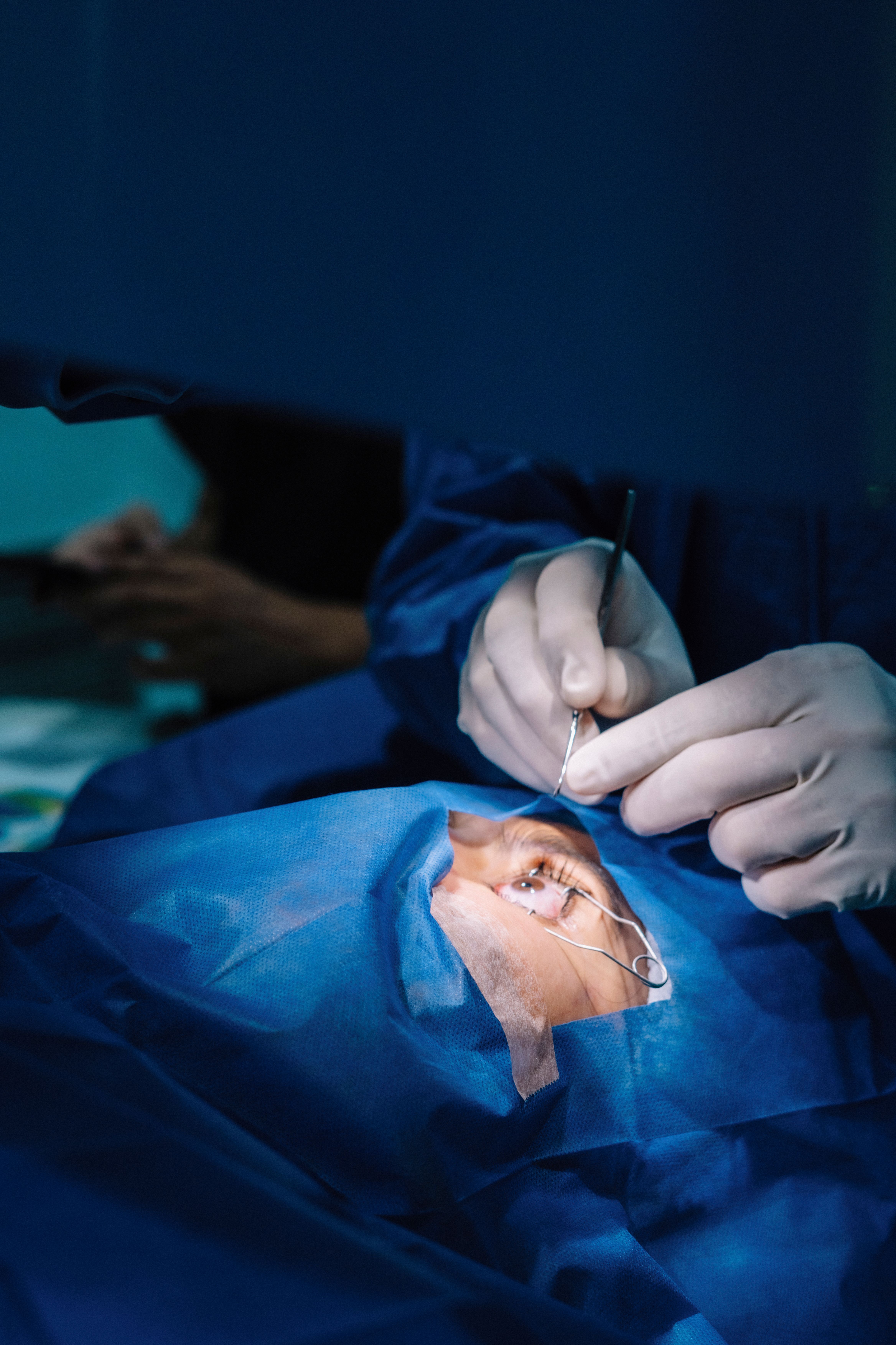 Surgery Eye Photos, Download The BEST Free Surgery Eye Stock Photos ...