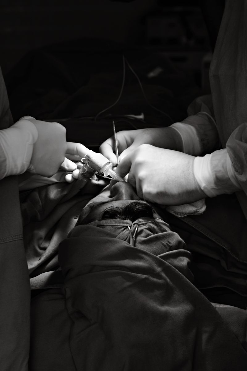Endoscopy Procedure Photos Download The Best Free Endoscopy Procedure