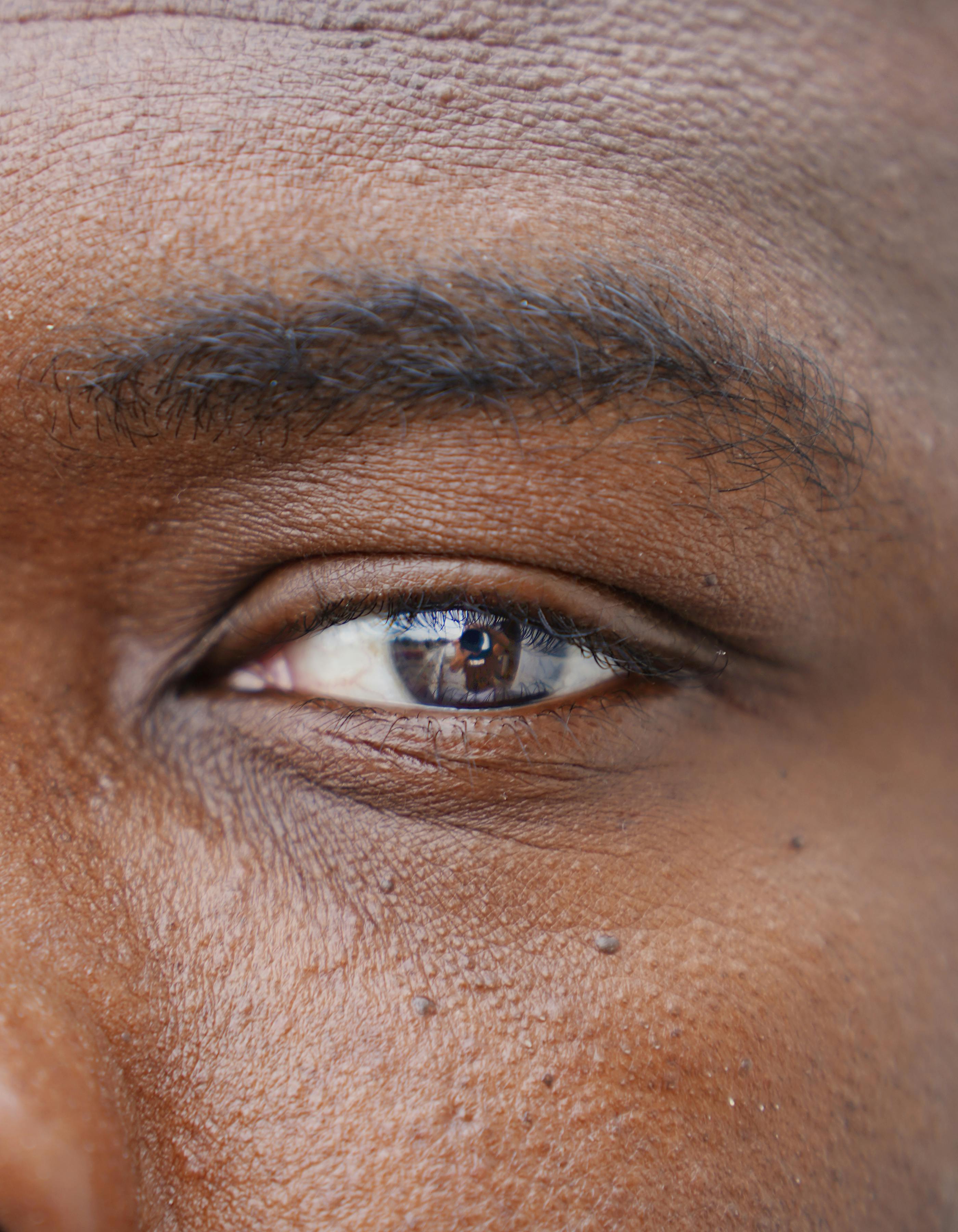 Attention Deficit Hyperactivity Disorder (Adhd) Photos, Download The ...