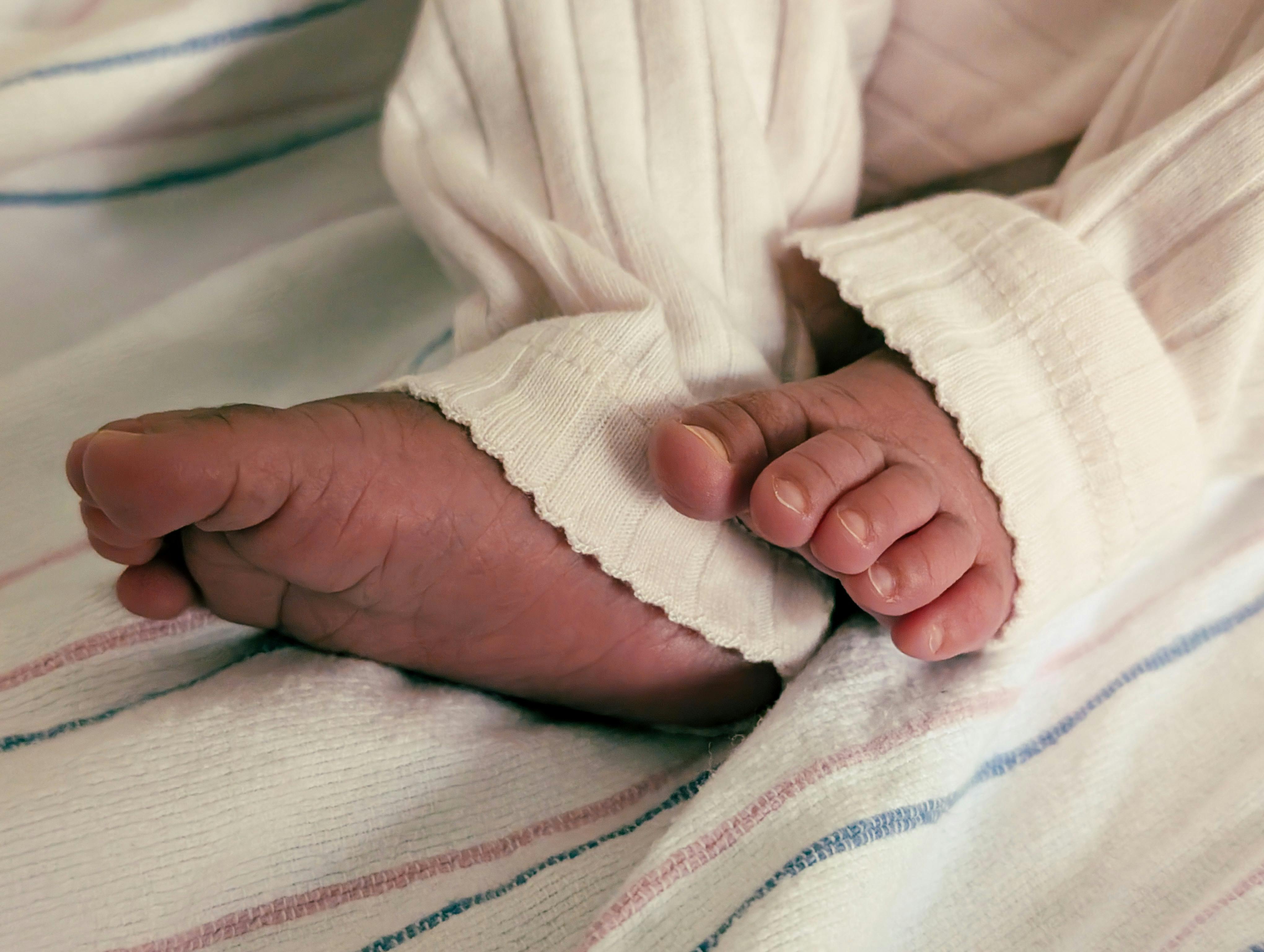 Gross Feet Photos, Download The BEST Free Gross Feet Stock Photos & HD ...