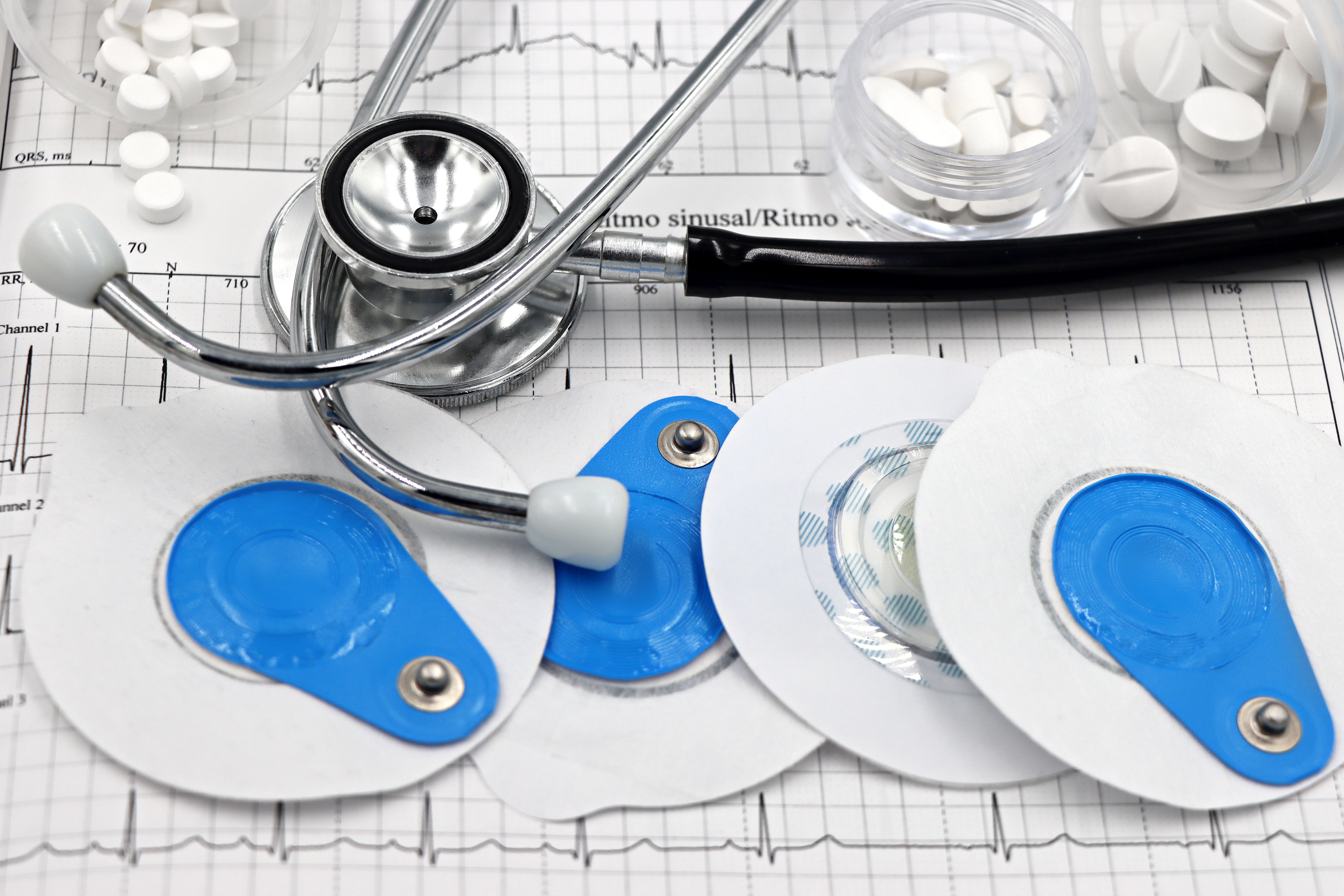 Cardiology Tools with ECG and Stethoscope · Free Stock Photo