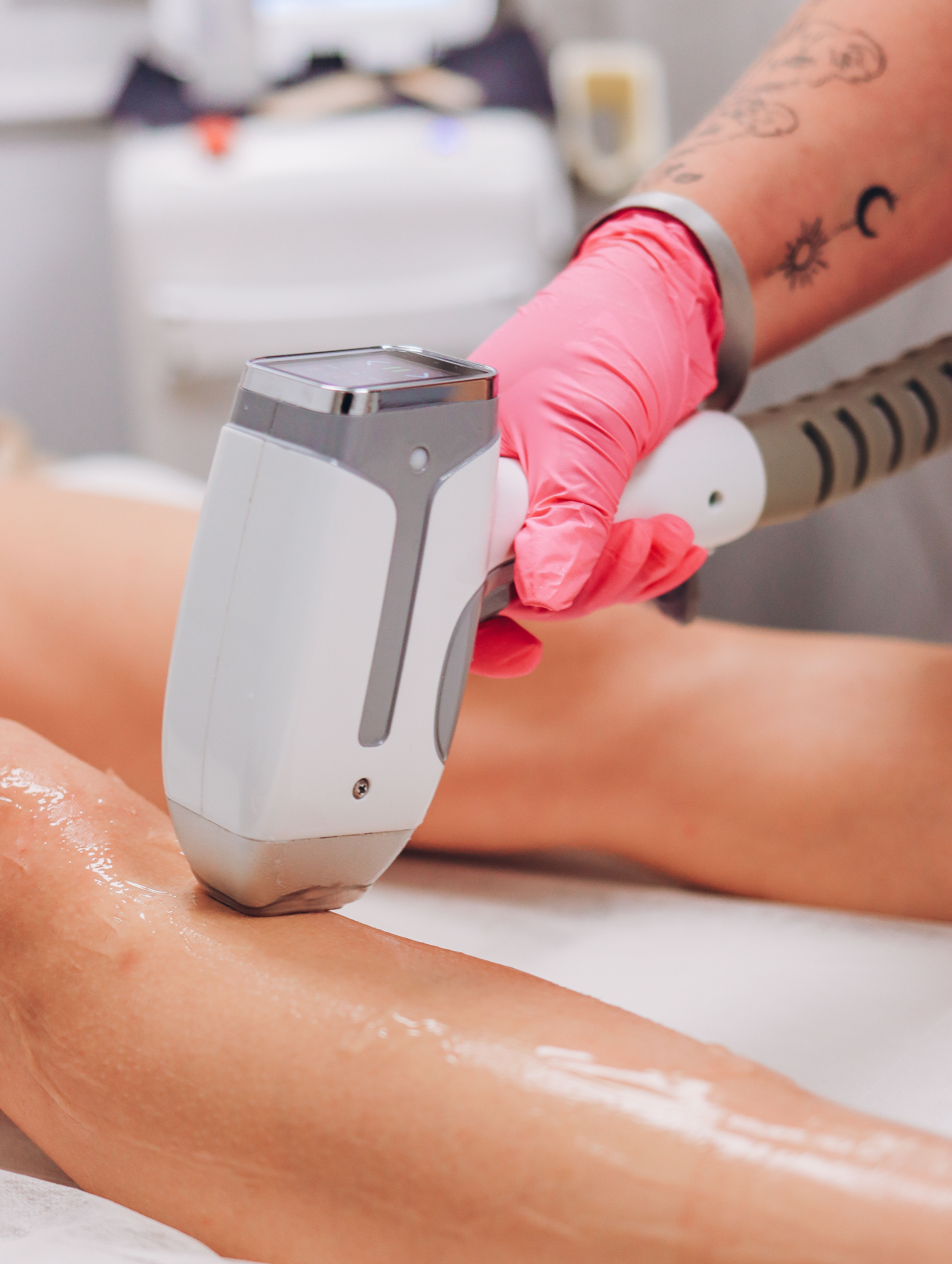 Laser Hair Removal Procedure in a Clinic · Free Stock Photo