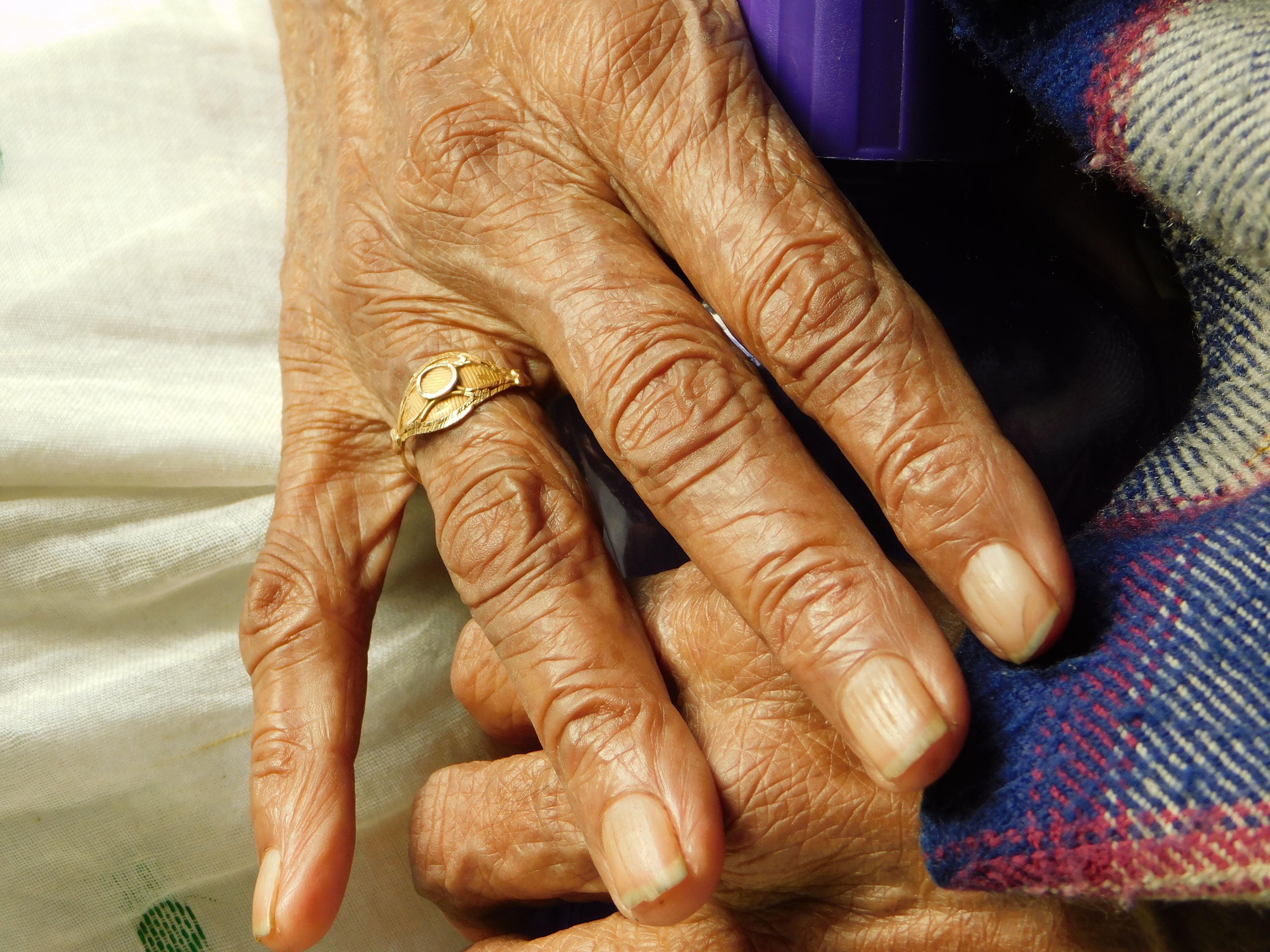 Arthritis Photos, Download The BEST Free Arthritis Stock Photos & HD Images