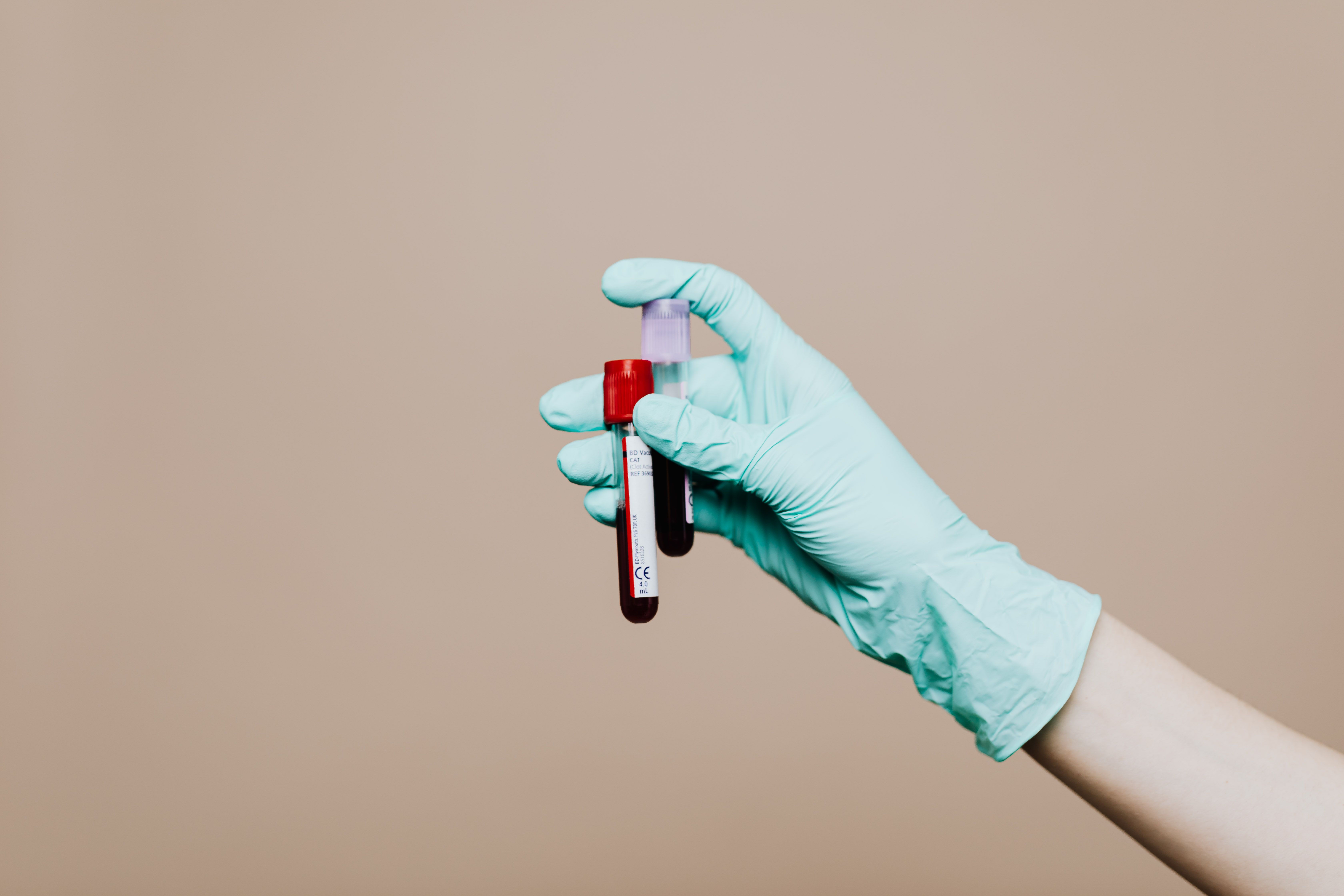 Anemia Photos, Download The BEST Free Anemia Stock Photos & HD Images