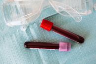 20 Blood Antonyms. Full list of opposite words of blood.