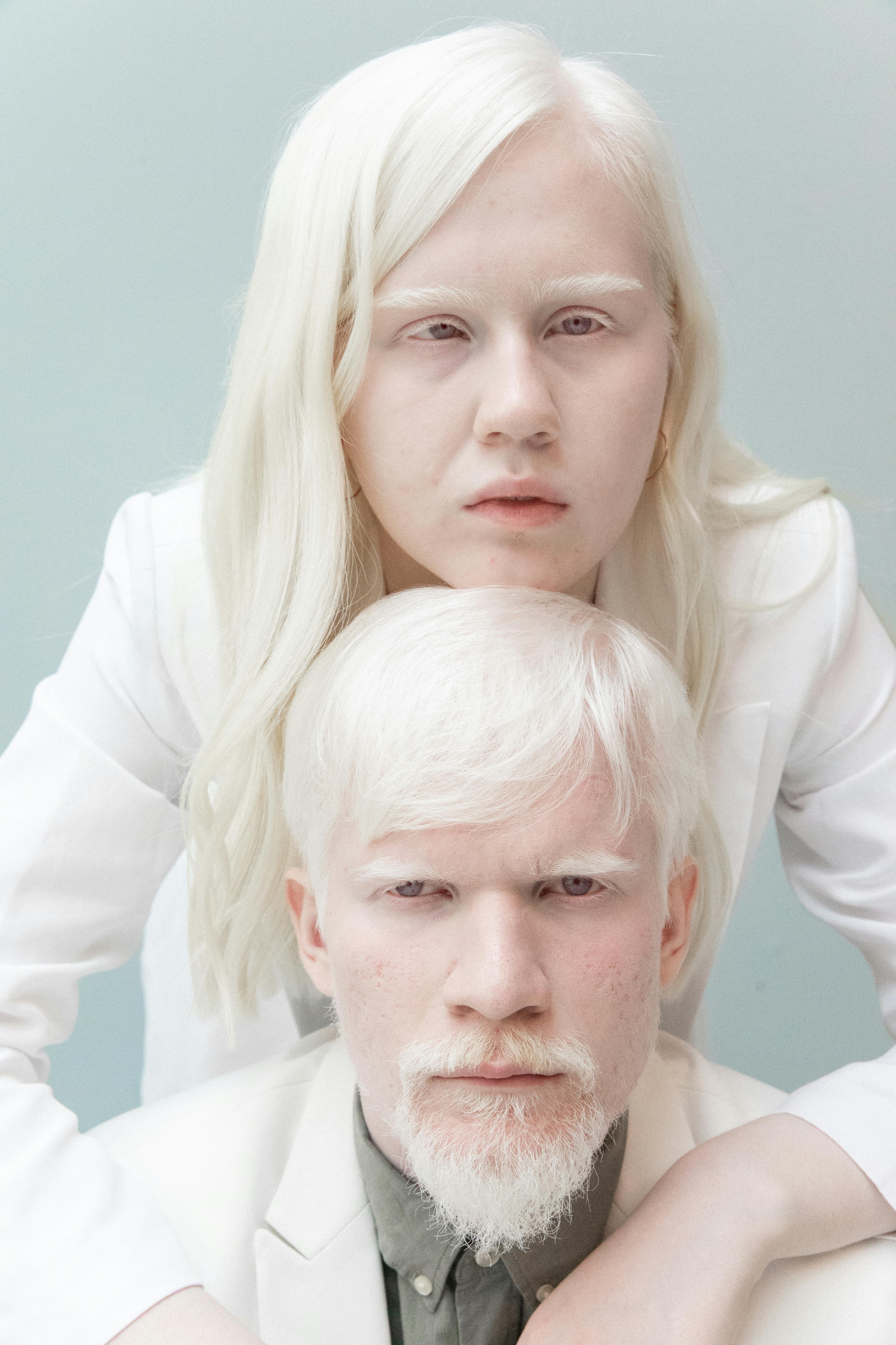 Expressive albino couple embracing in studio · Free Stock Photo