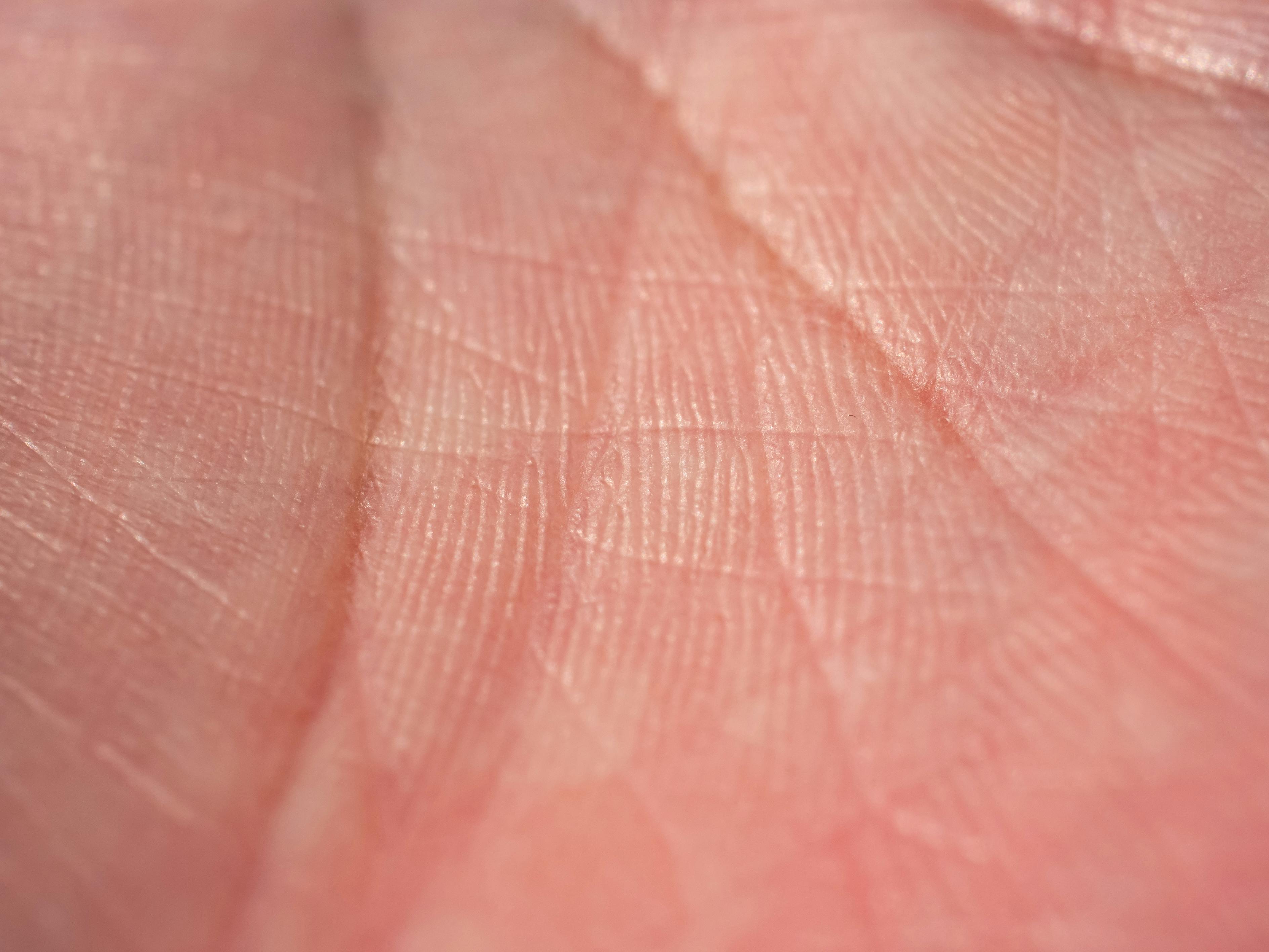 Palm of a Human Hand in Macro Photography · Free Stock Photo