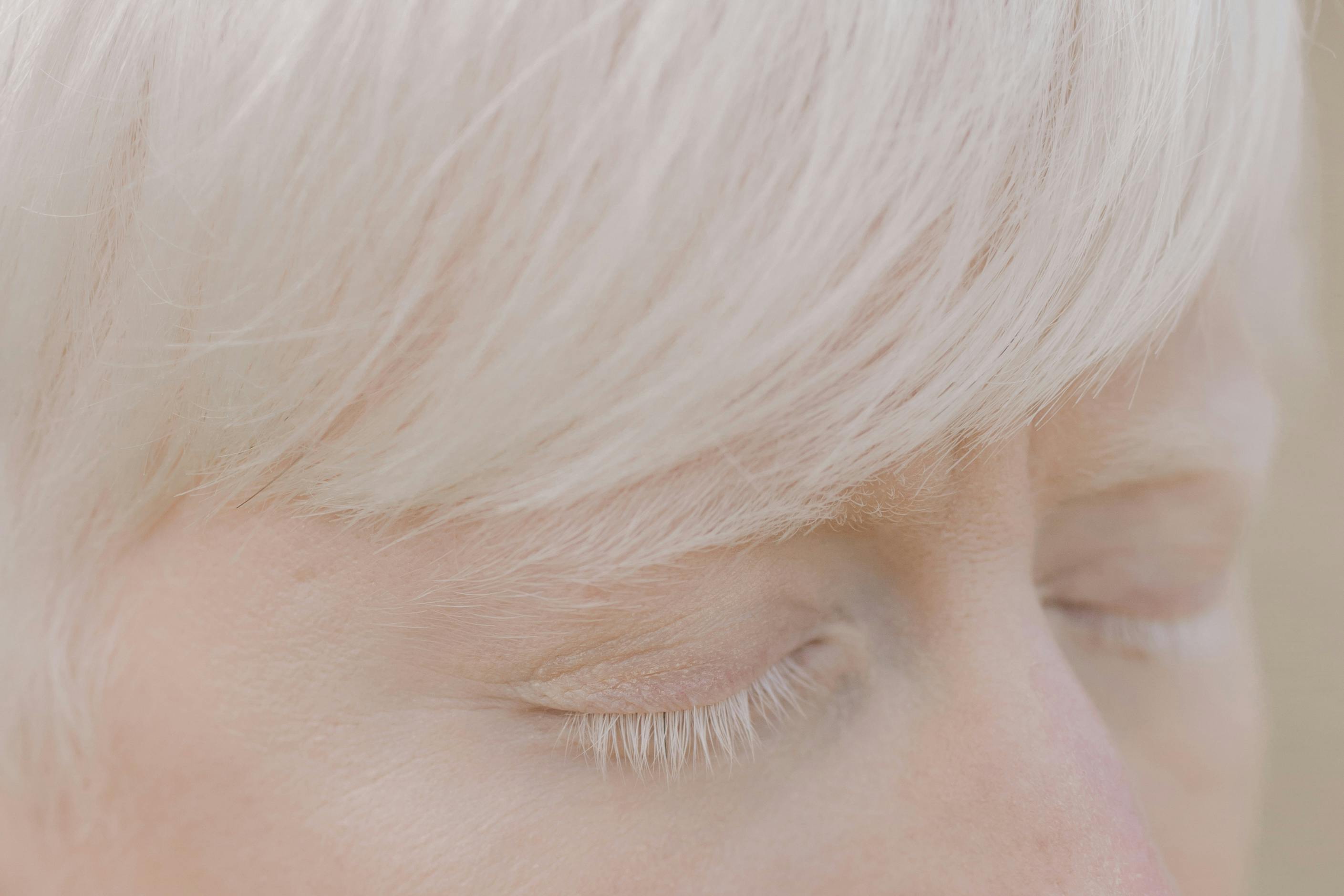 Person with White Hair Eyebrows and Eyelashes · Free Stock Photo
