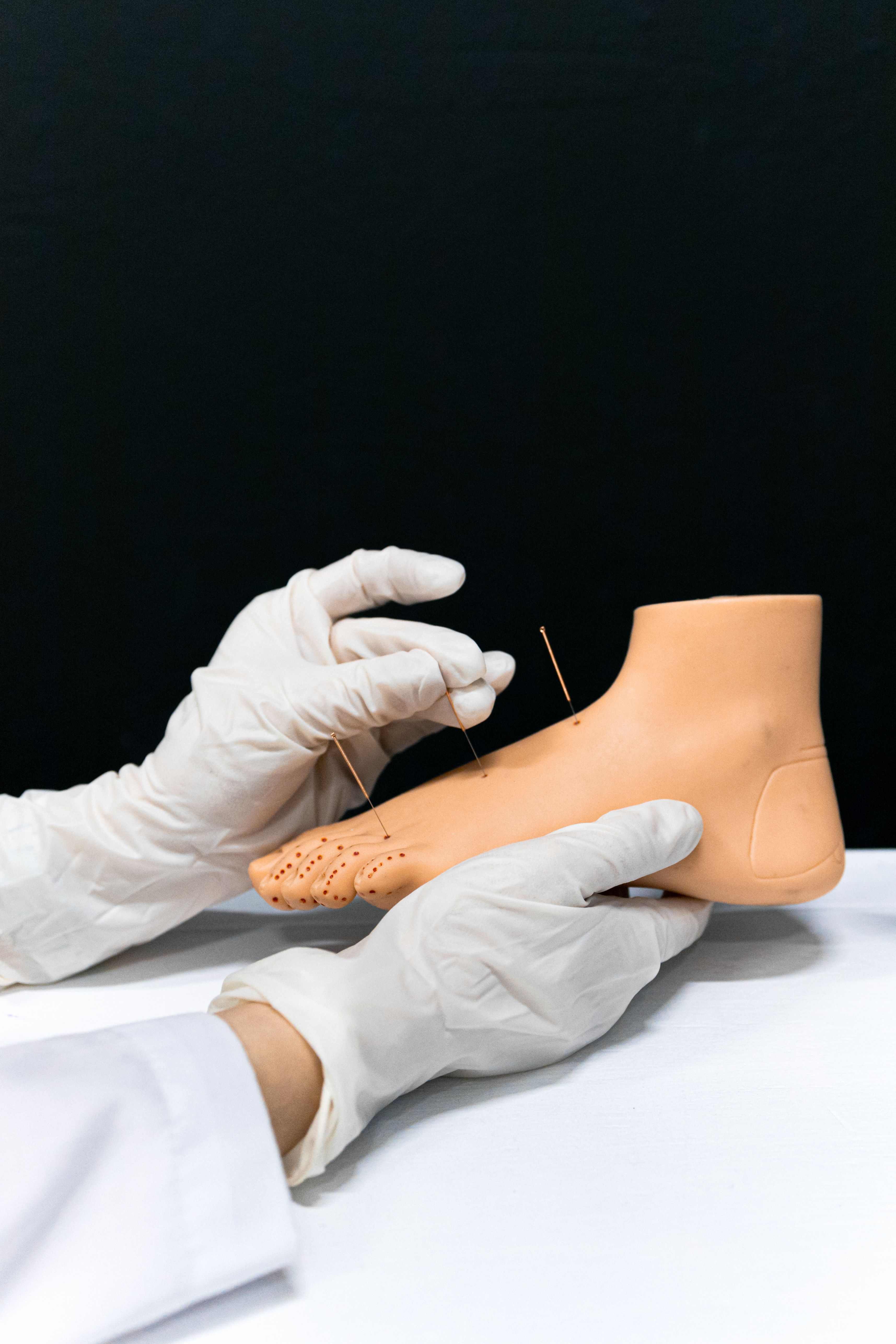 Person Using an Acupuncture Needle · Free Stock Photo