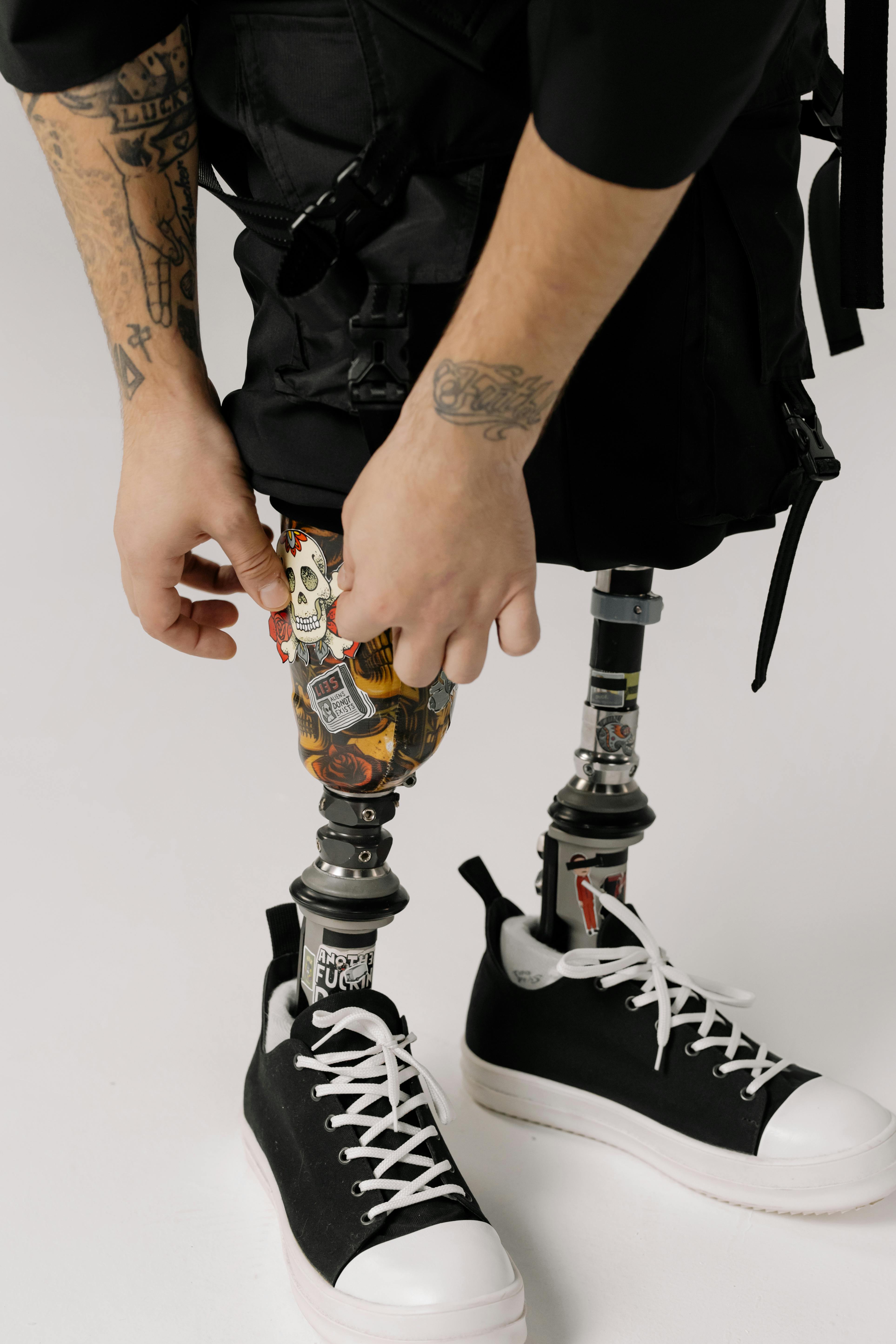 Close-Up Shot of a Person Putting Sticker on Prosthetic Legs · Free ...