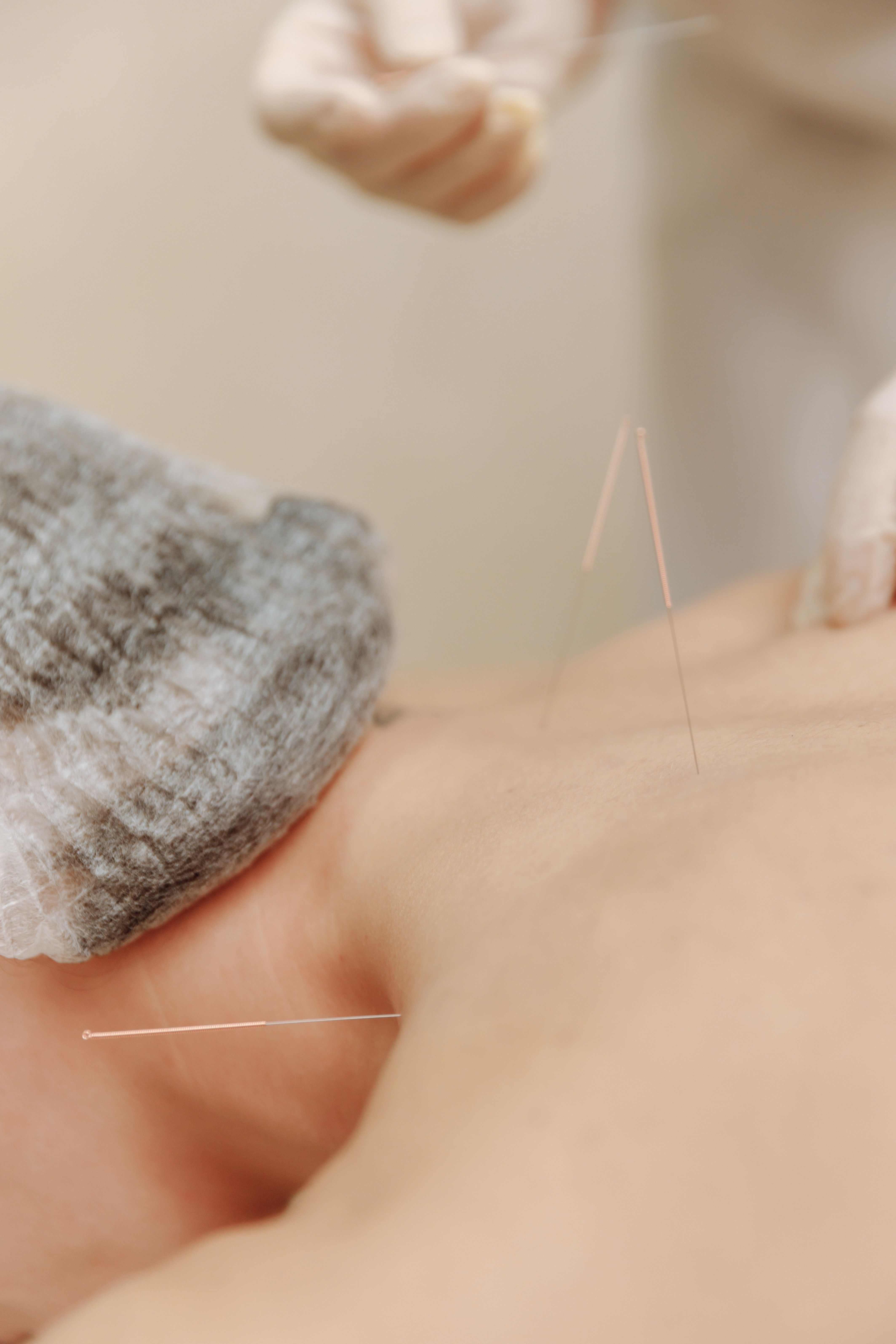 3,000+ Best Needle Photos · 100% Free Download · Pexels Stock Photos