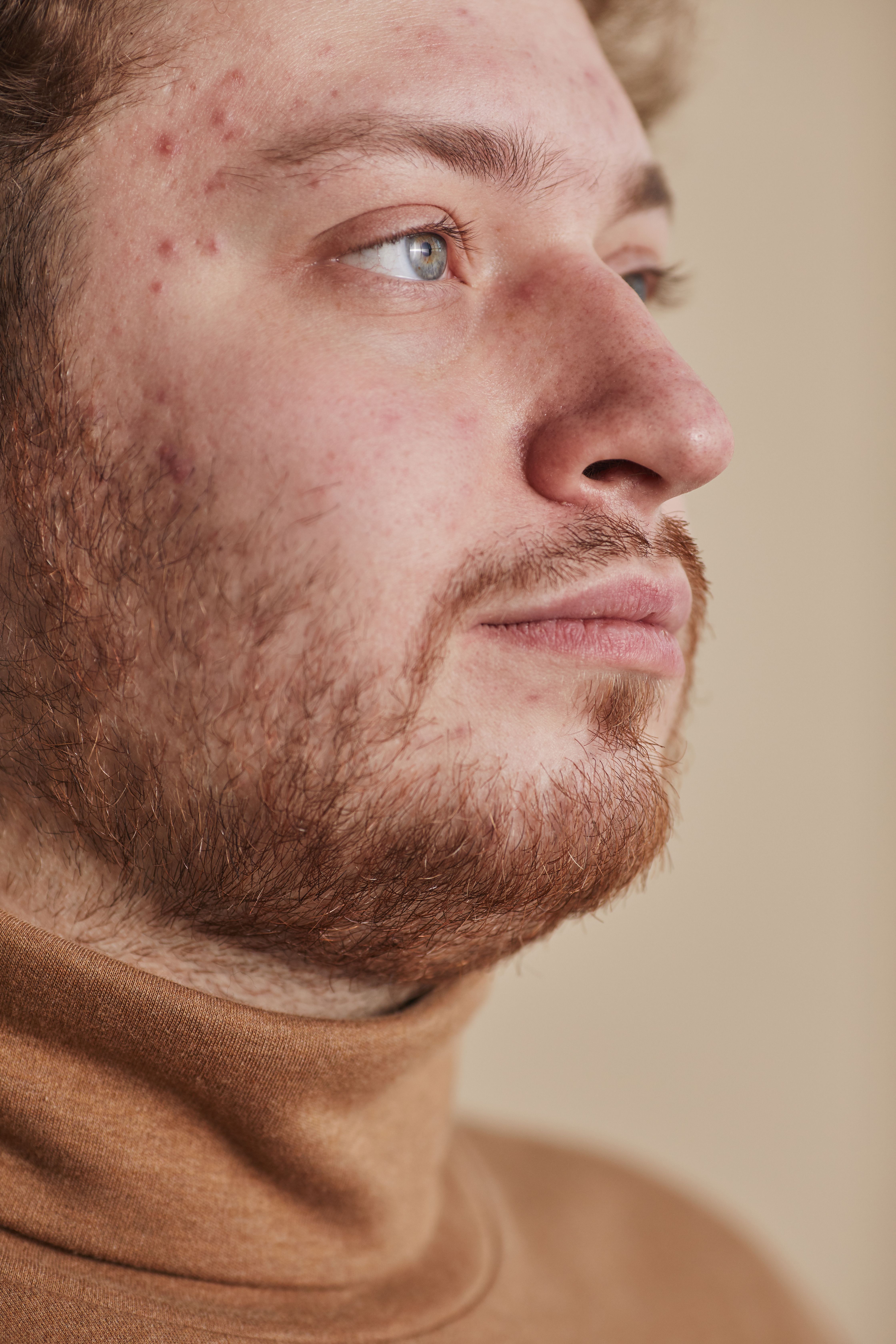 Skin Disease on Person's Face · Free Stock Photo