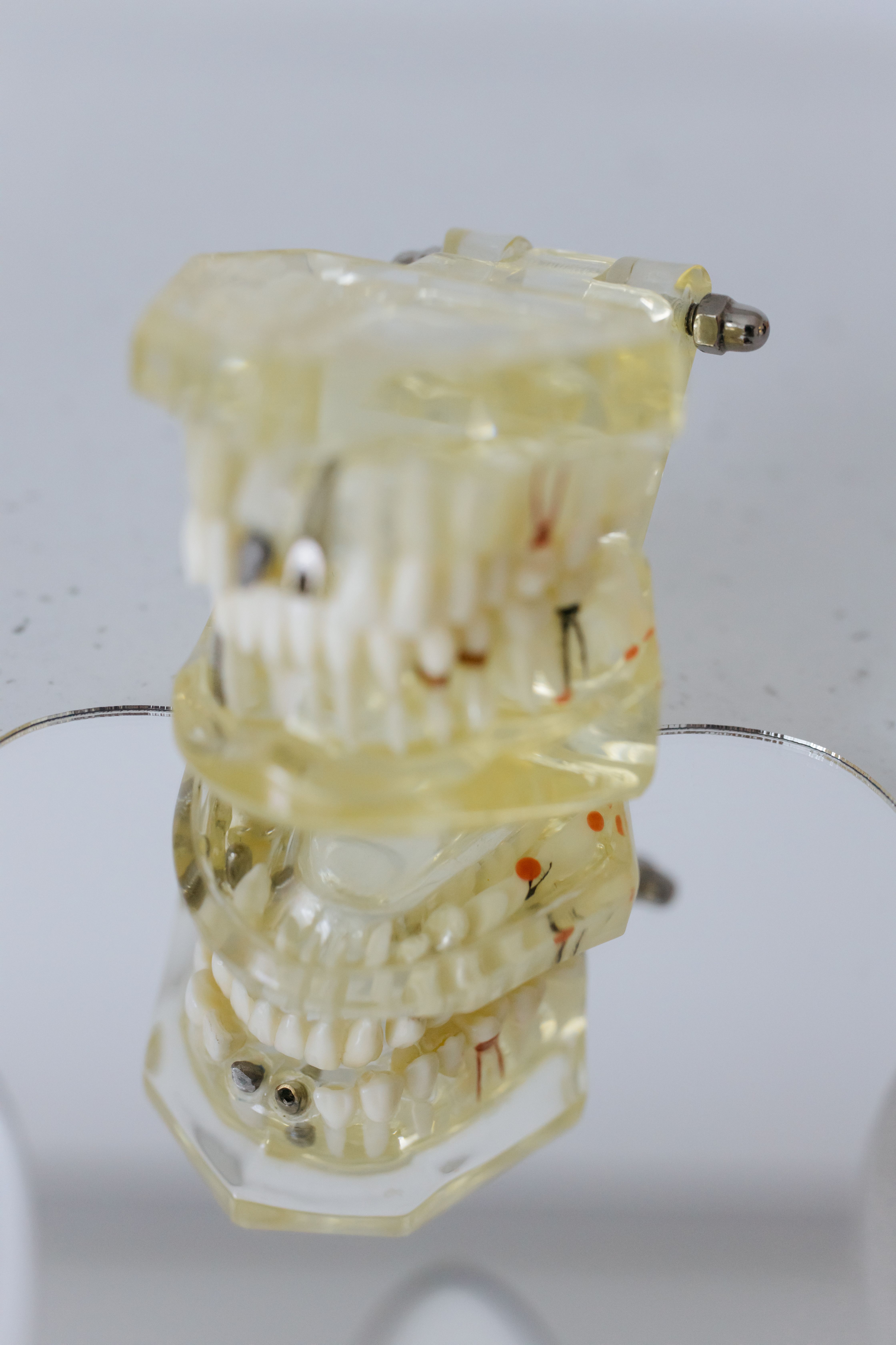 Close-Up Shot of Dental Implant Model · Free Stock Photo