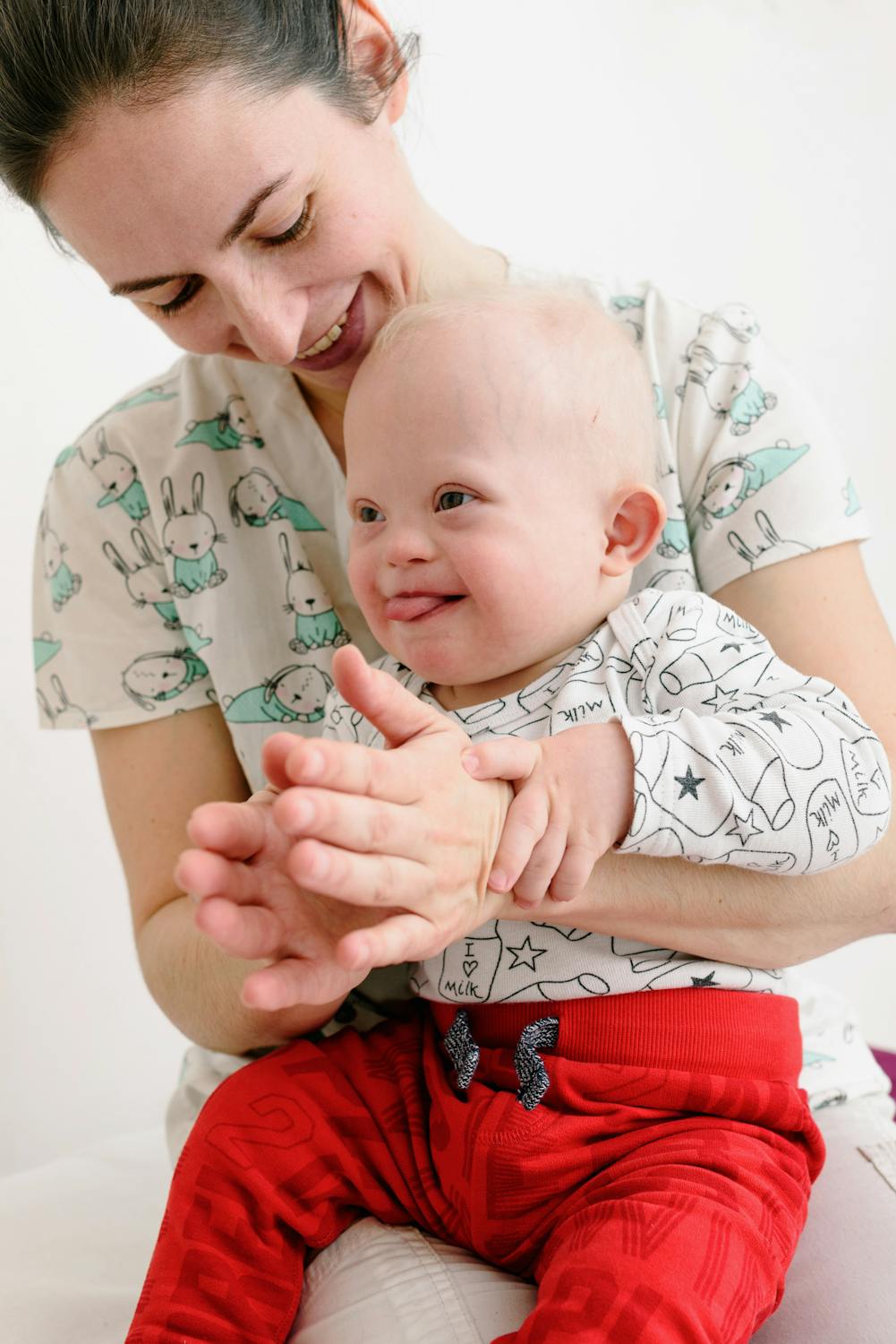 Symptoms Of Down Syndrome symptoms-of-down-syndrome