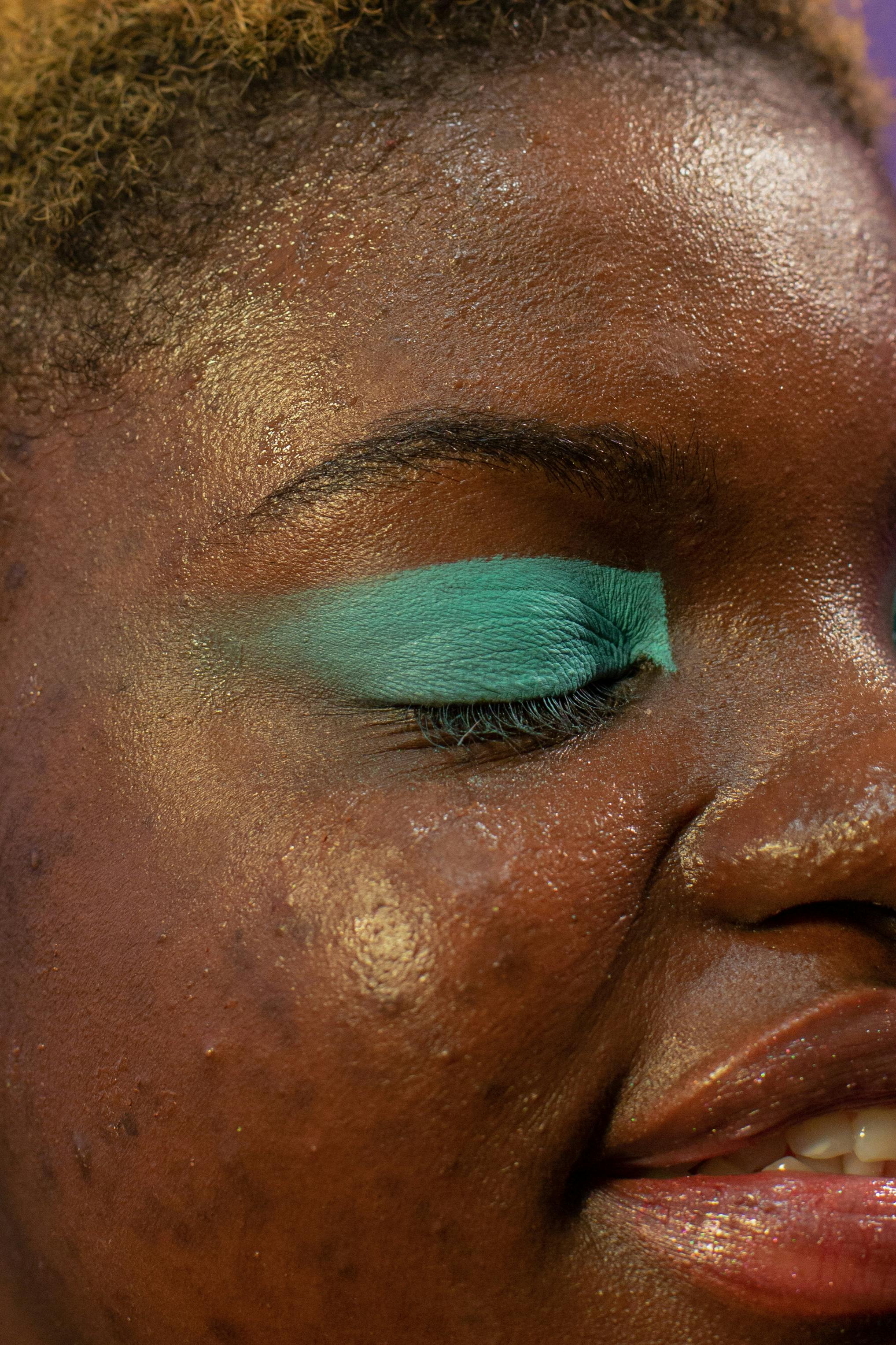 Woman With Acne Photos, Download Free Woman With Acne Stock Photos & HD ...