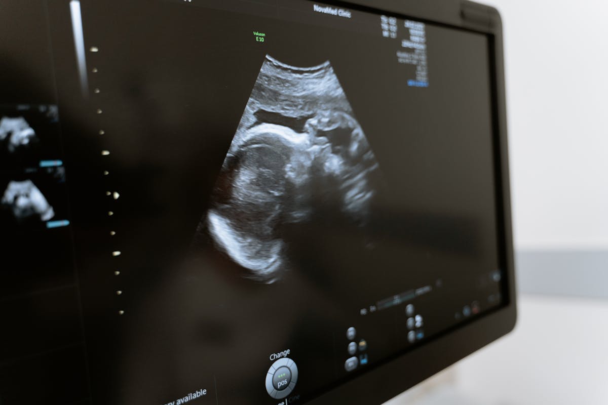 Ultrasound Photos, Download The BEST Free Ultrasound Stock Photos & HD ...
