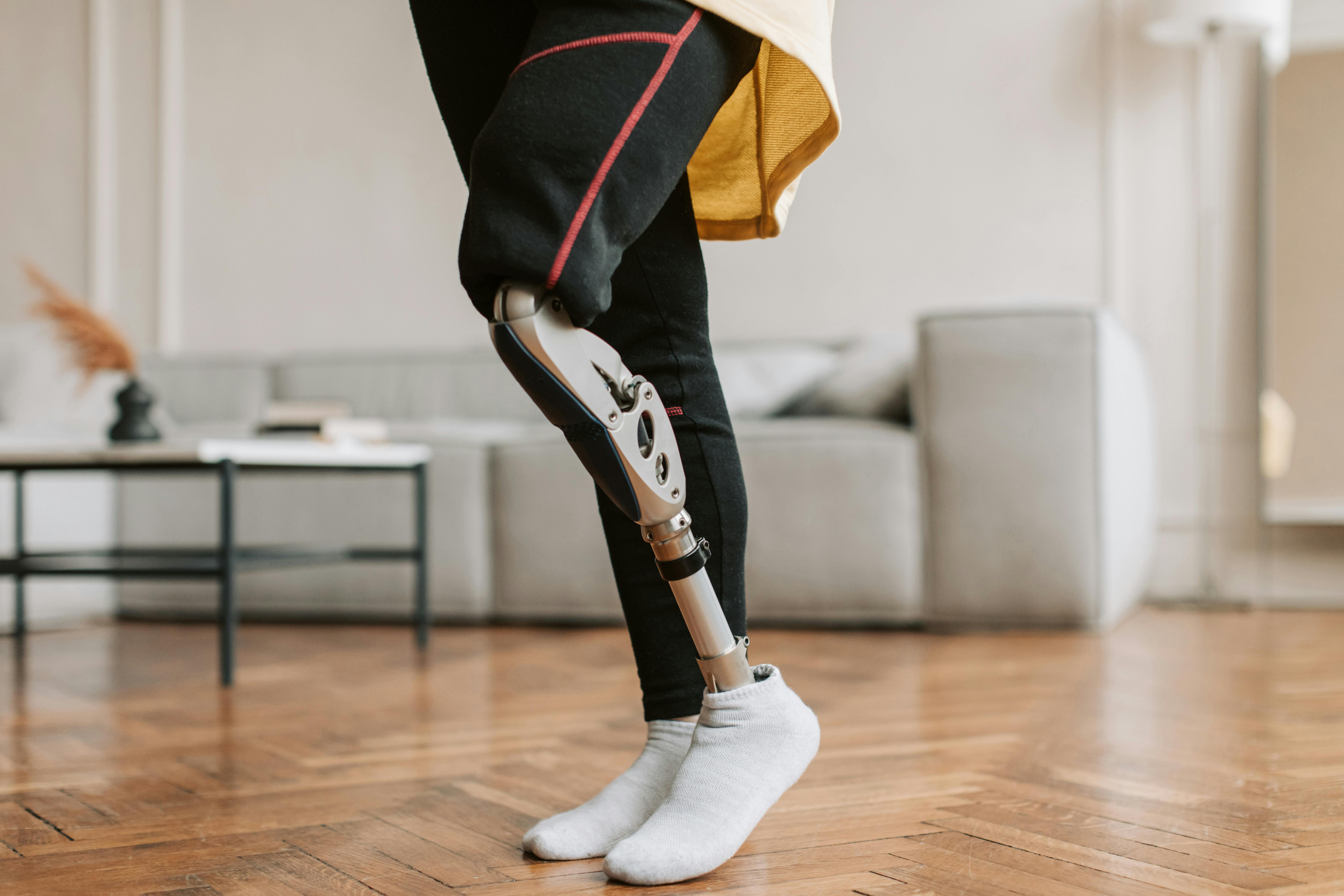 Close-up Photo of Bionic Leg · Free Stock Photo