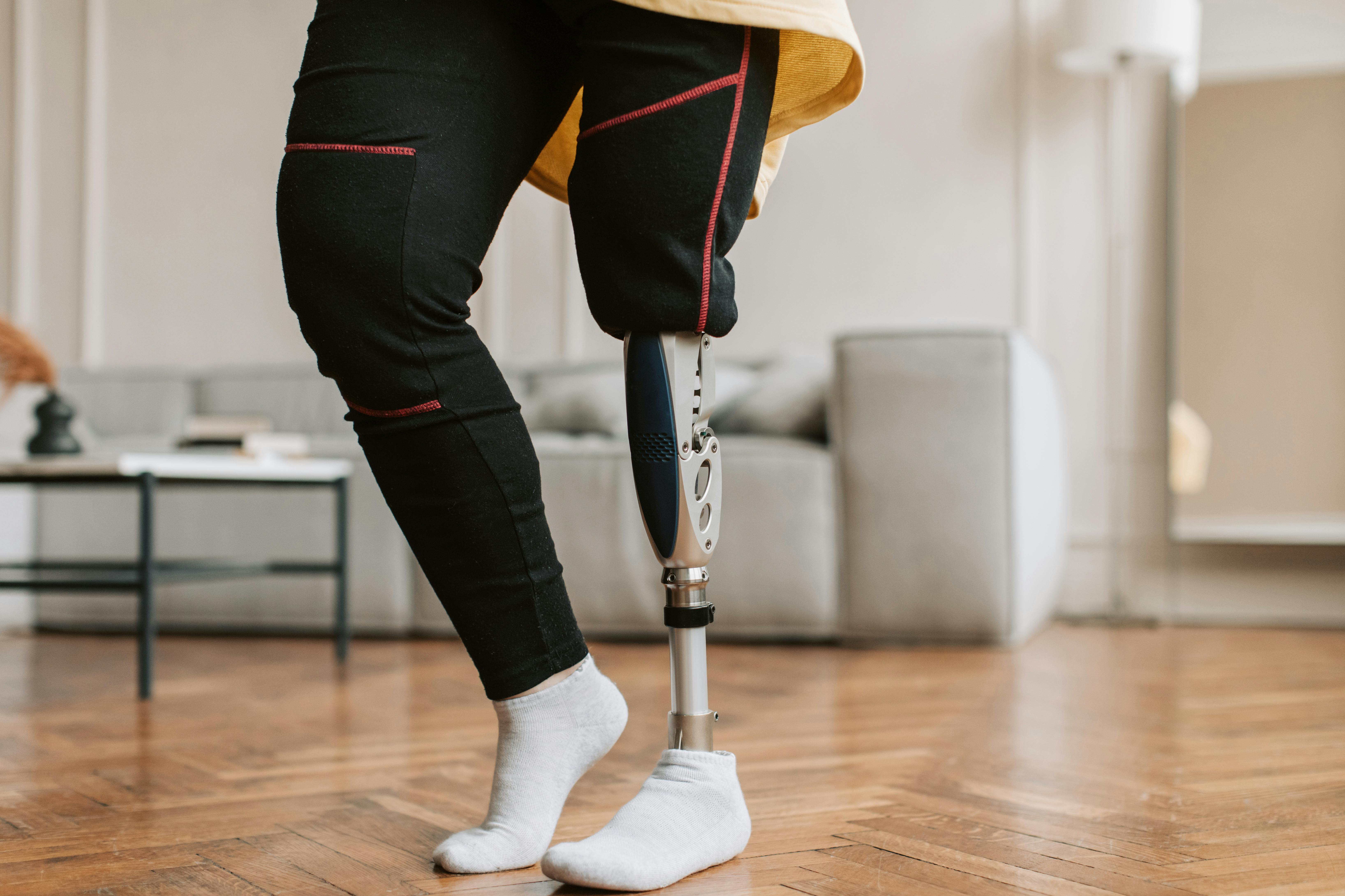 Close-up Photo of Bionic Leg · Free Stock Photo