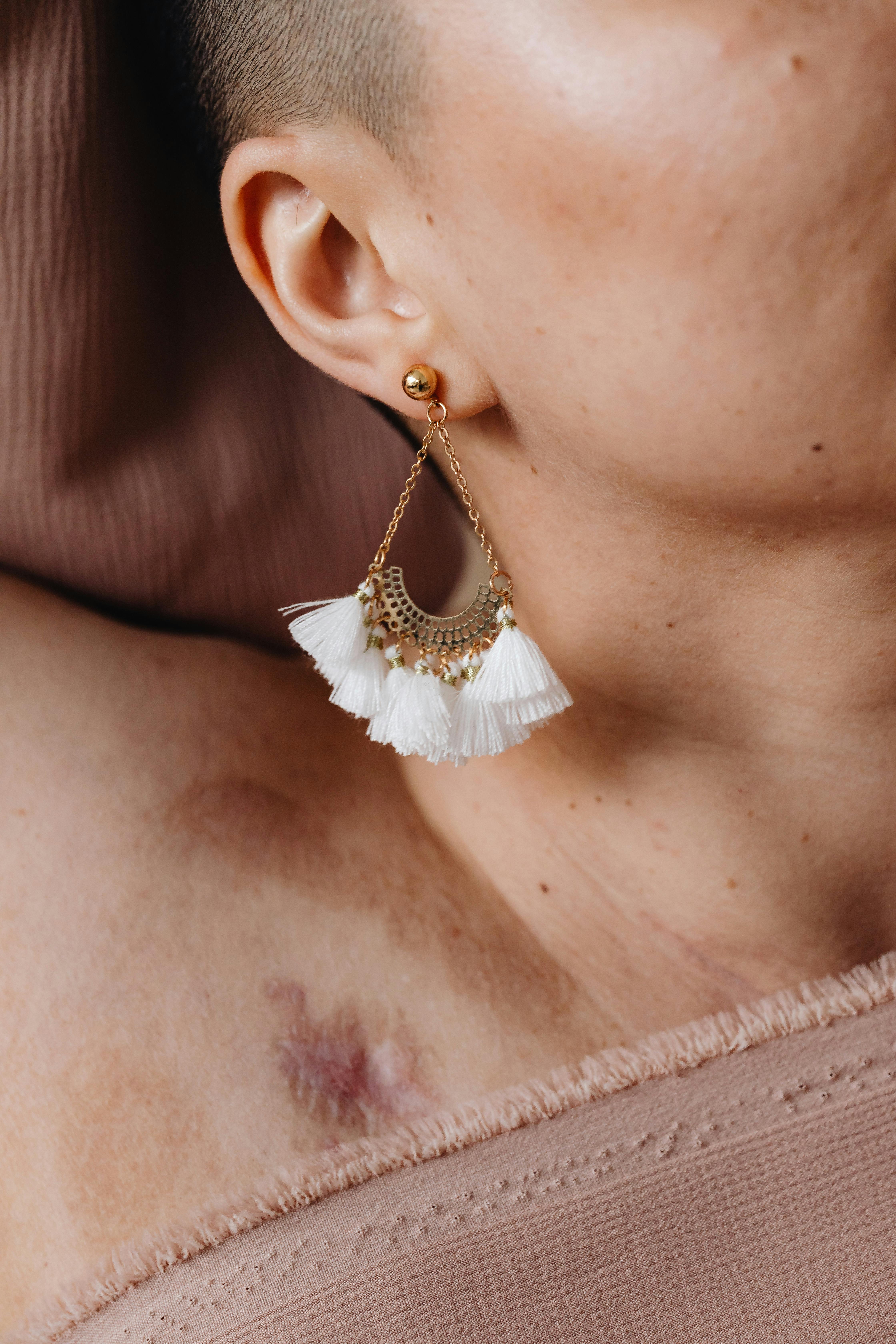 Gold Scar Fortnite Photos, Download The BEST Free Gold Scar Fortnite ...