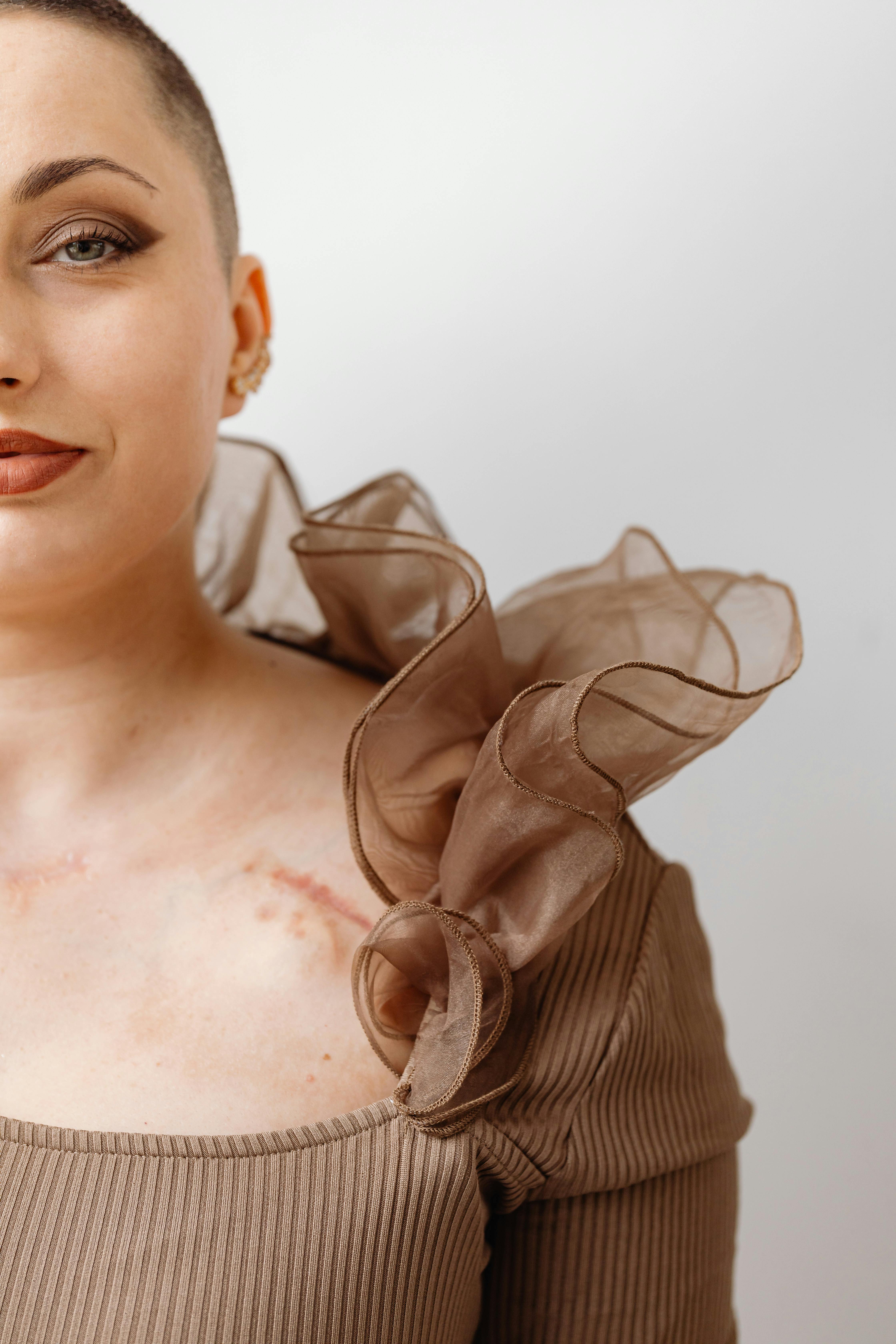 Beautiful Scar Photos, Download The BEST Free Beautiful Scar Stock ...