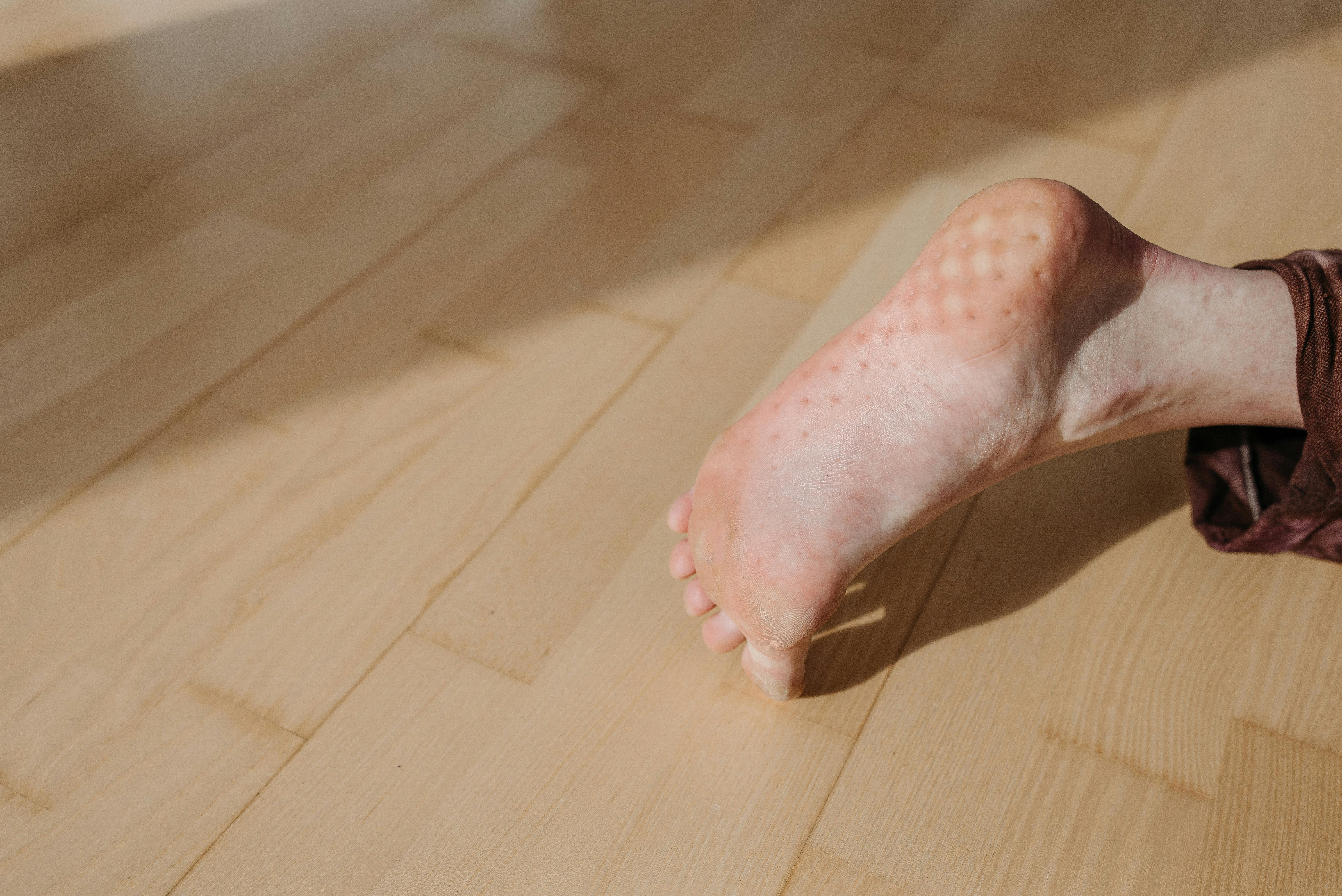 Foot of a Man Lying on the Floor with Puncture Marks · Free Stock Photo