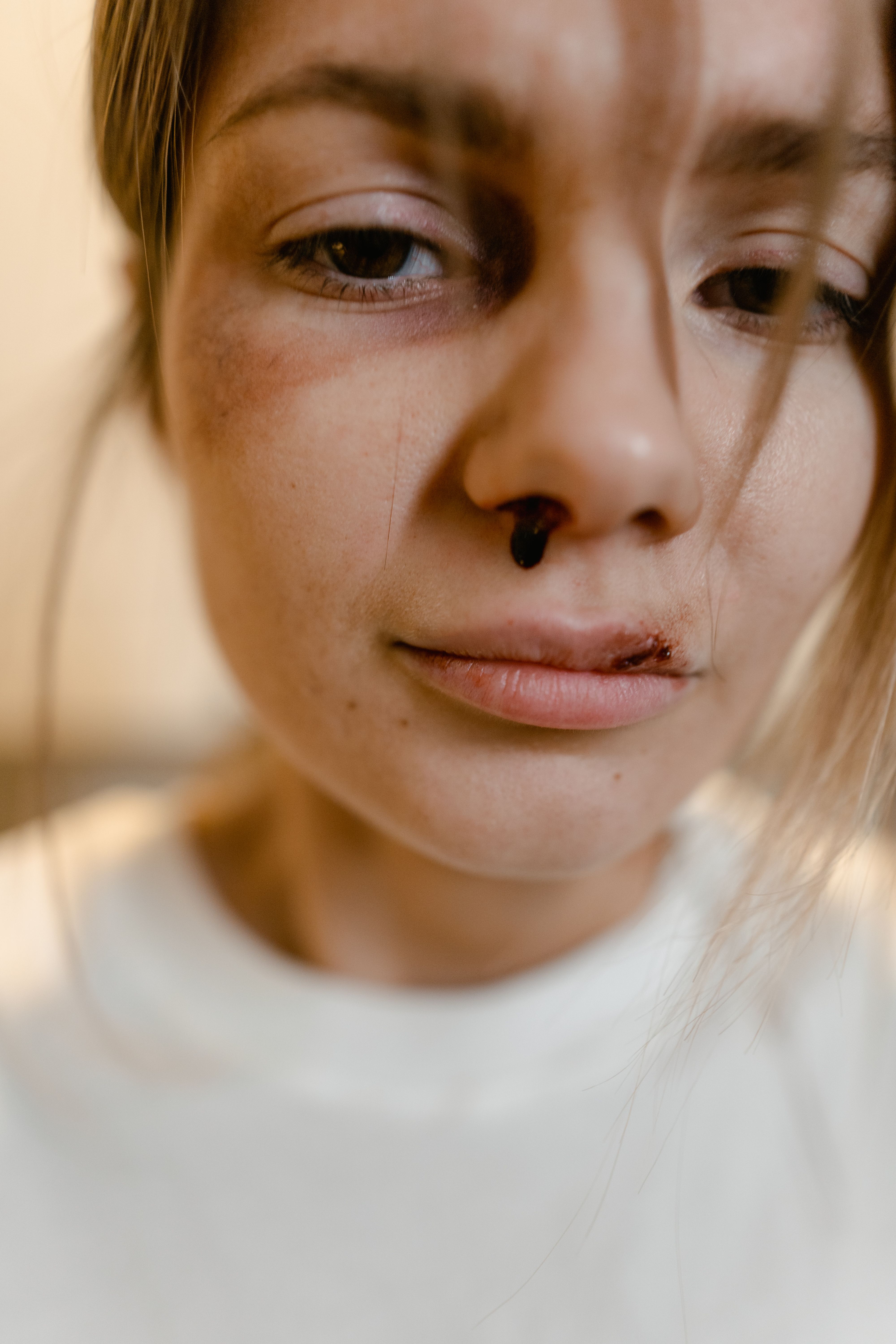 305+ Best Free Scars Stock Photos & Images · 100% Royalty-Free HD Downloads