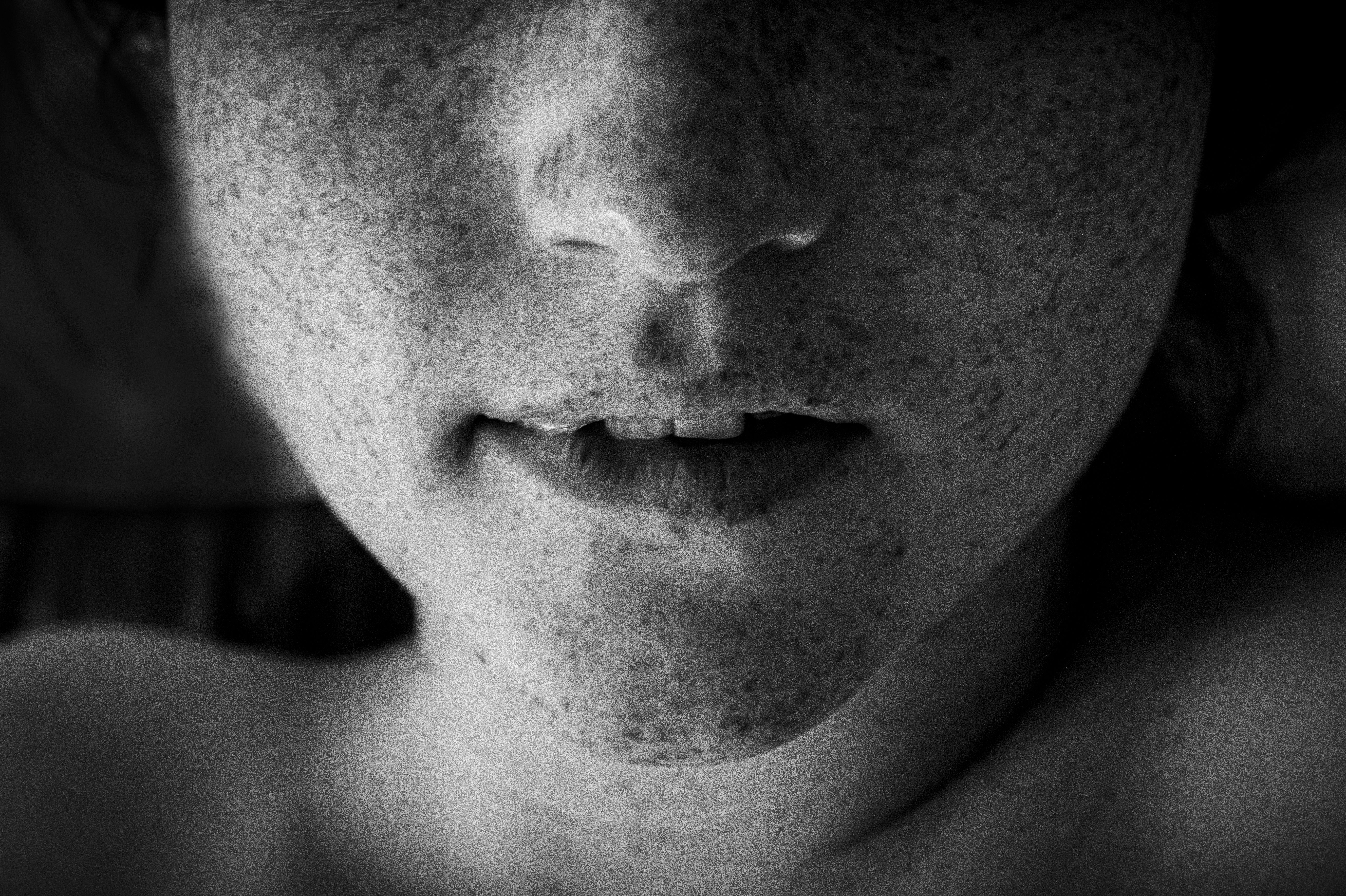 Spotty Face Photos, Download The BEST Free Spotty Face Stock Photos ...