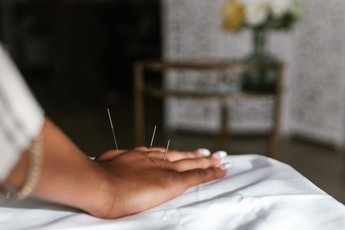 Does BCBS Cover Acupuncture? What Insurance Plans Include It