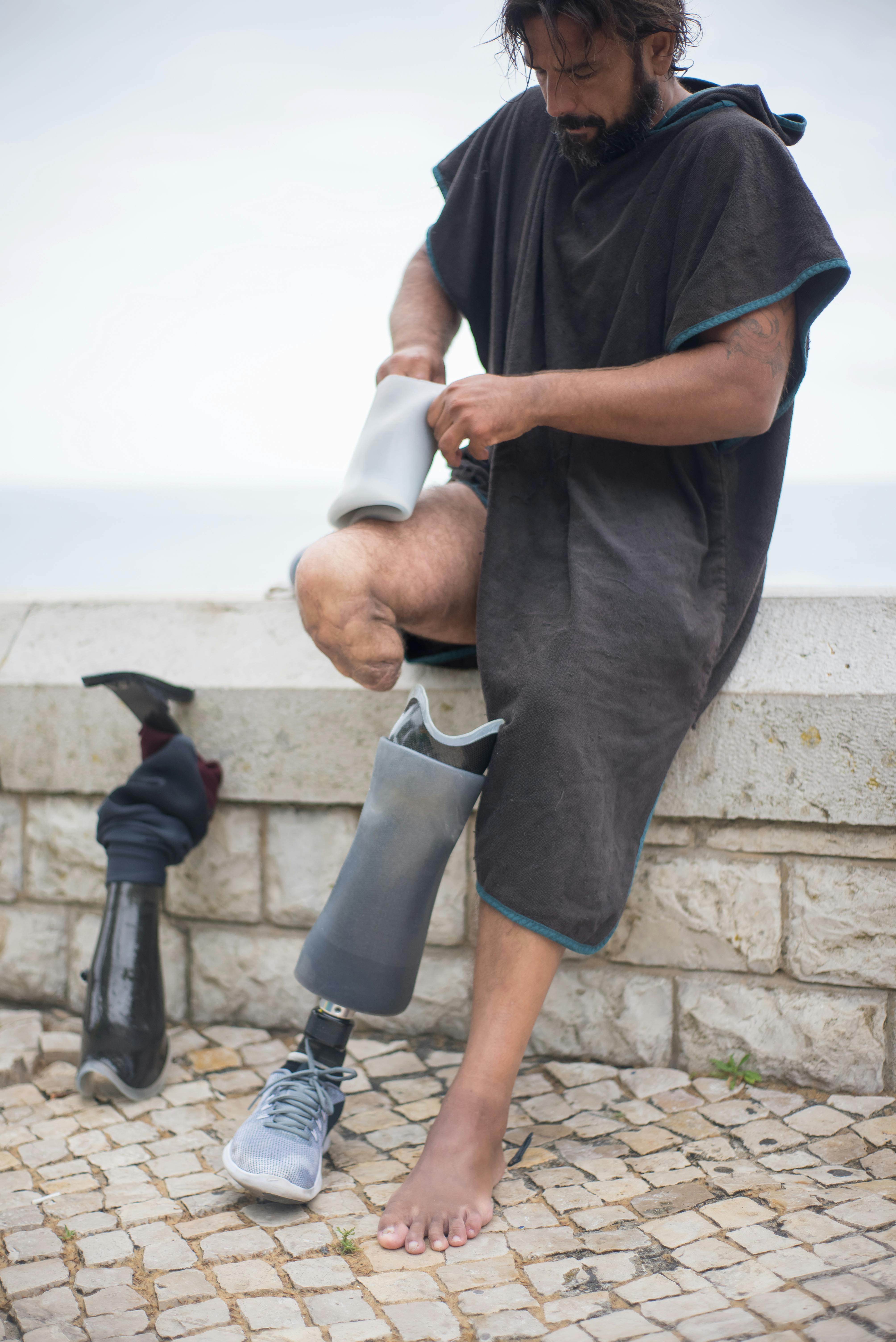 Young Man With Prosthetic Leg Smiling Portrait High-Res Stock Photo ...