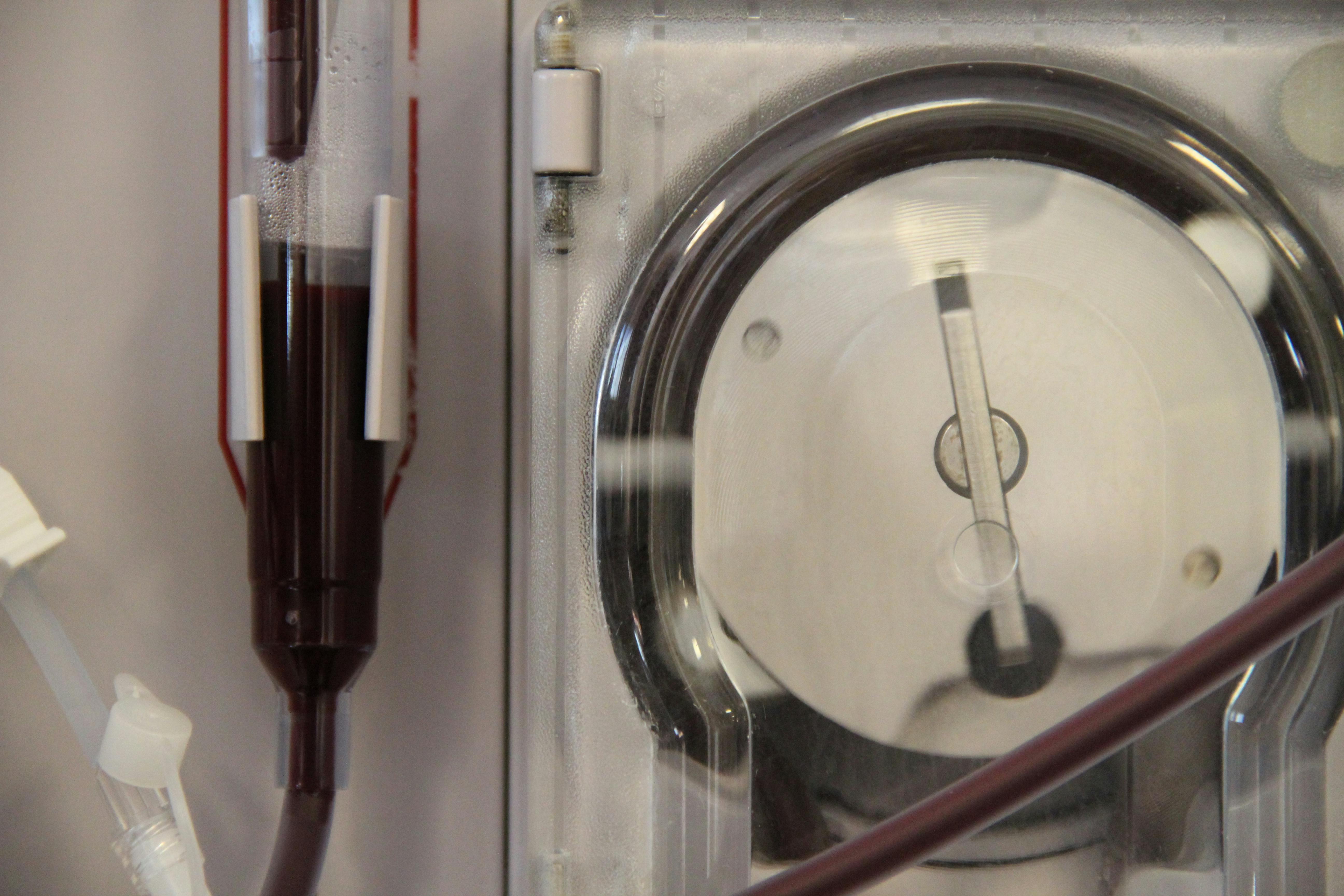 Free stock photo of blood, Dialysis machine, hematology