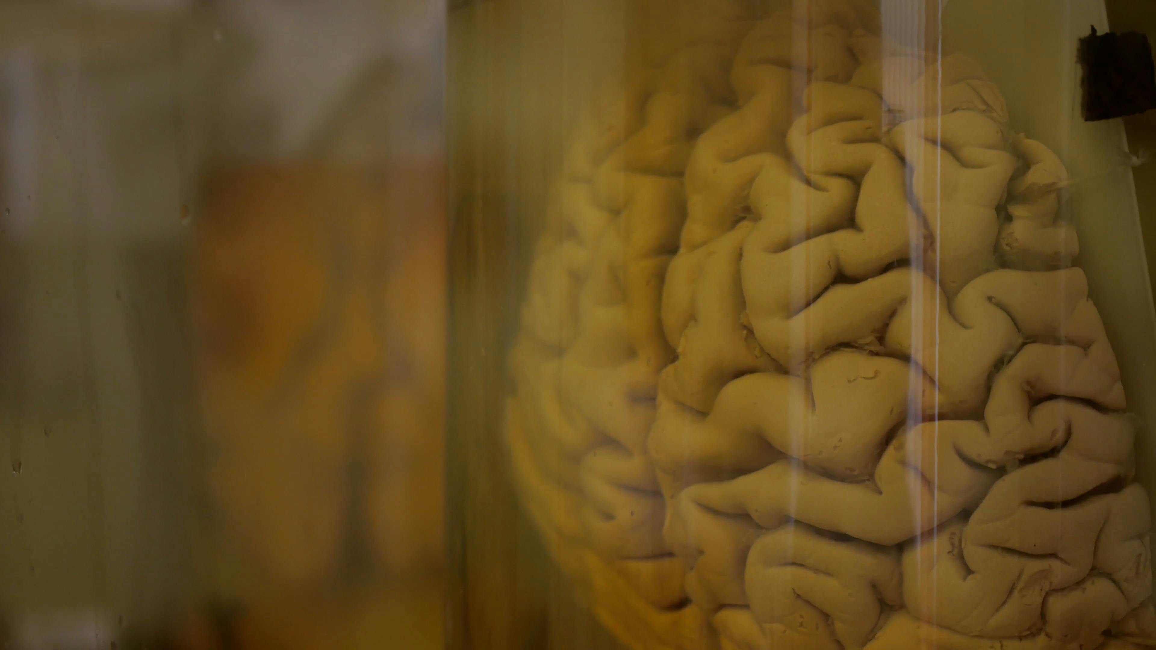 Histology Videos, Download The BEST Free 4k Stock Video Footage ...