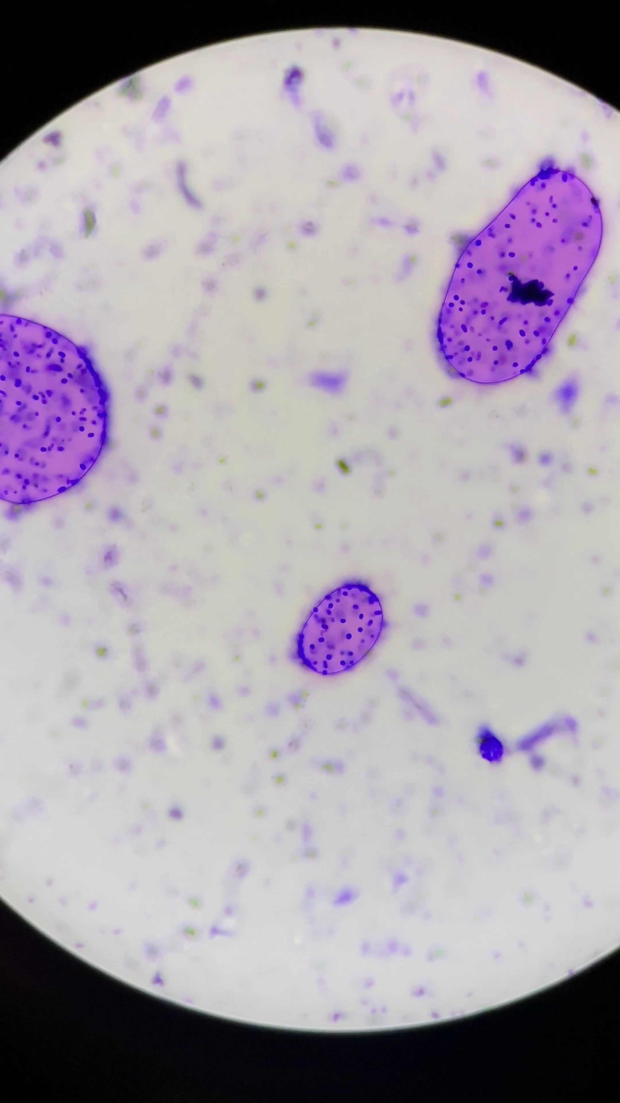 Microscope And Bacteria Cells Videos, Download The BEST Free 4k Stock ...