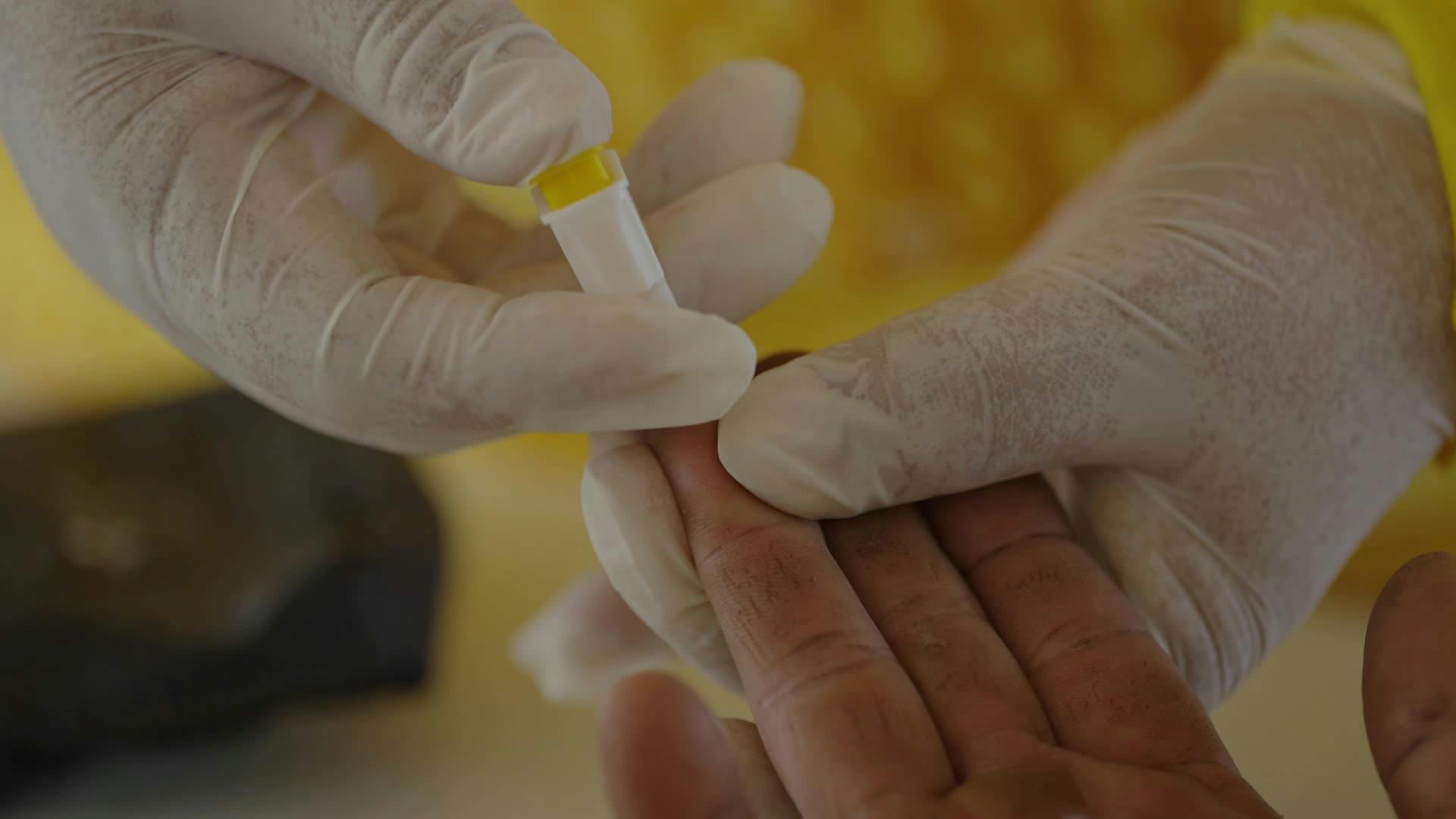 Blood Sugar Testing Procedure with Glucometer Free Stock Video Footage ...