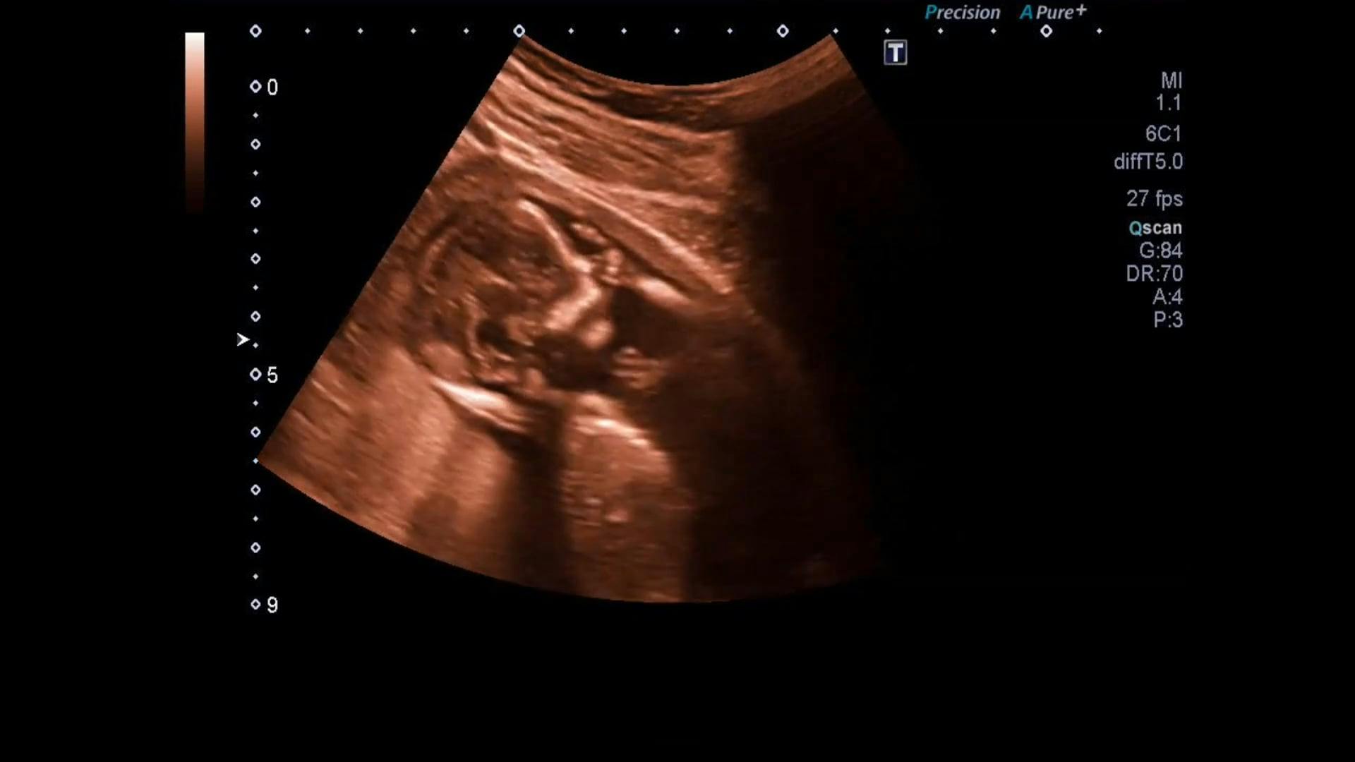 Video of Baby's Ultrasound Free Stock Video Footage, Royalty-Free 4K ...