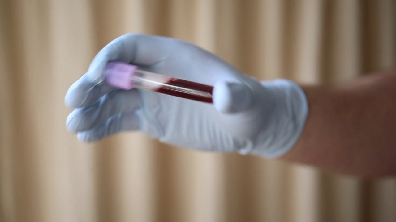 Blood Test Videos, Download The BEST Free 4k Stock Video Footage ...