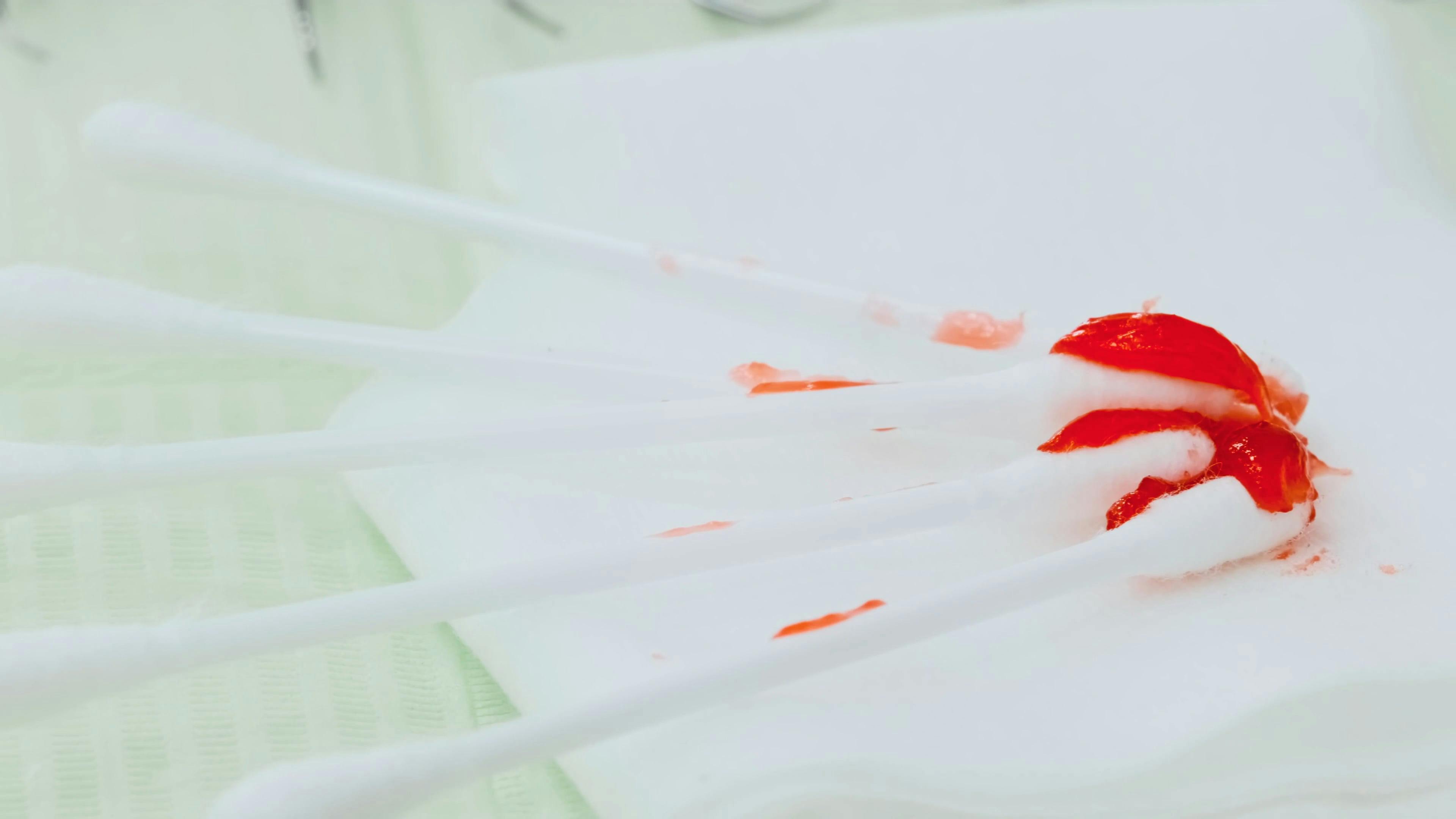 Blood Bleeding Videos, Download The BEST Free 4k Stock Video Footage ...