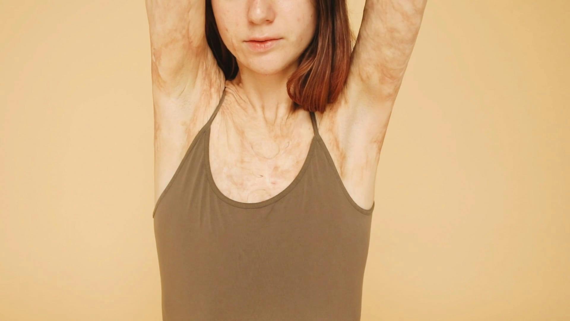 Recover Body Videos, Download The BEST Free 4k Stock Video Footage ...