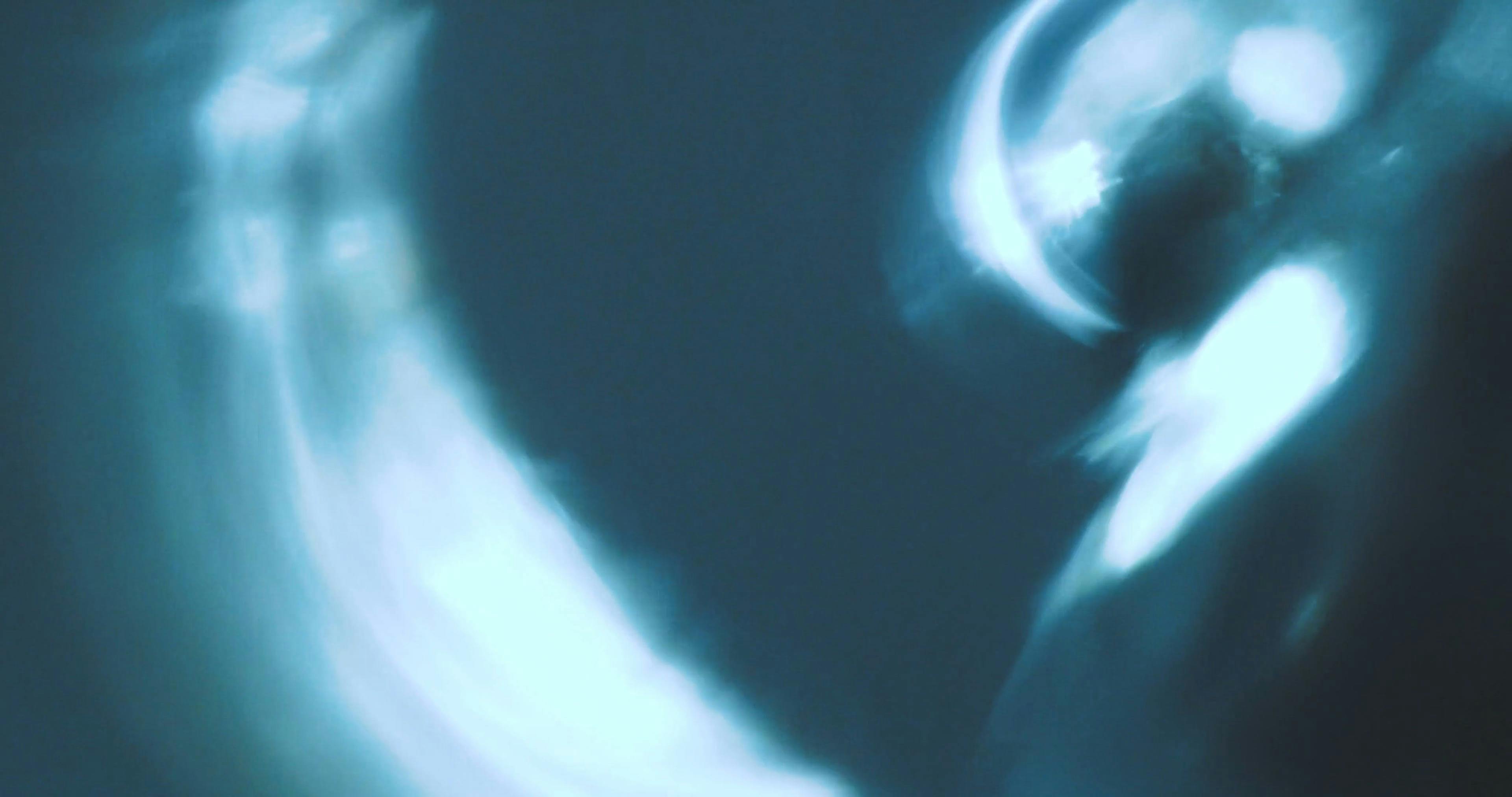 Lens Effect Videos, Download The BEST Free 4k Stock Video Footage ...