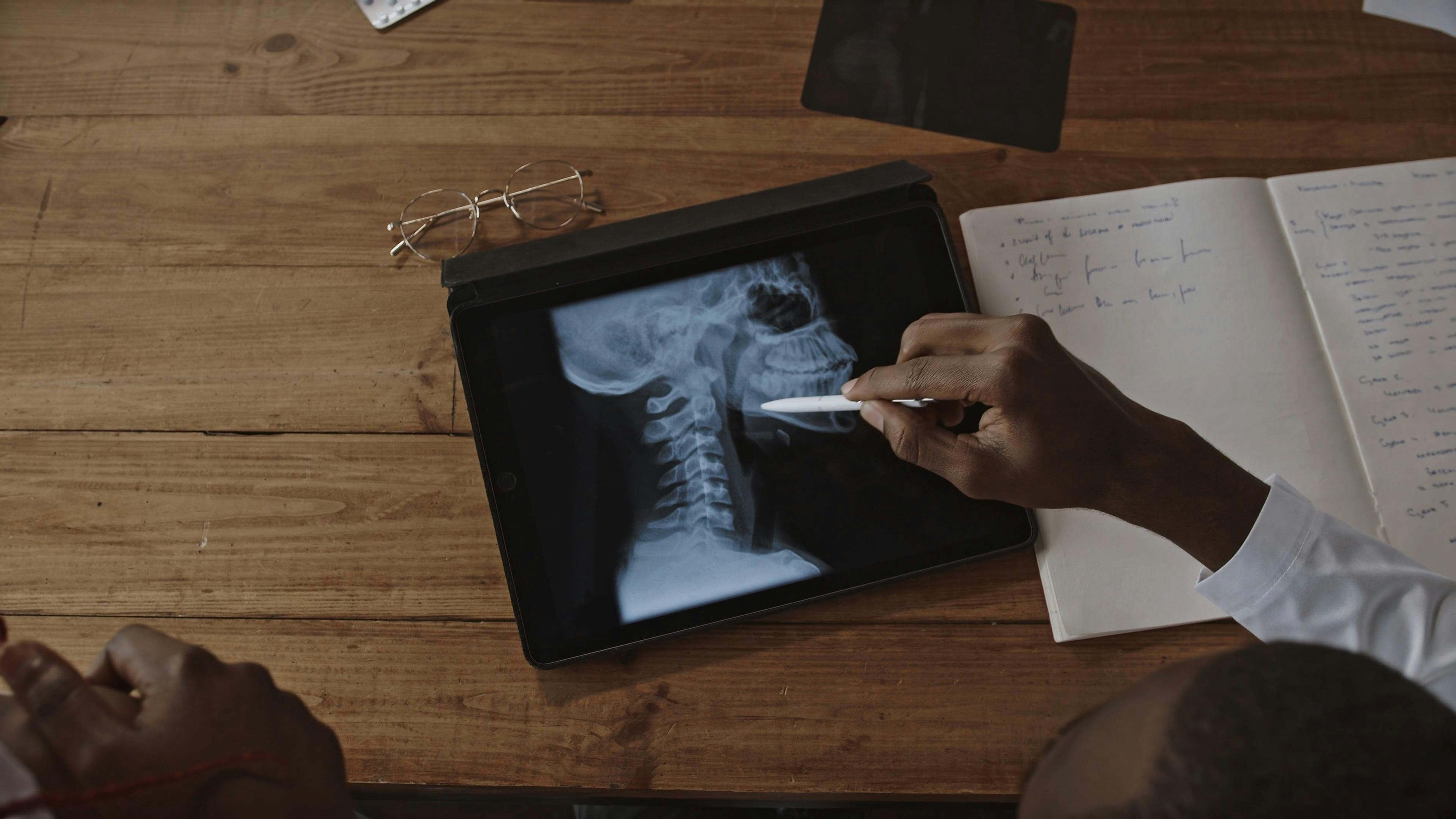 Doctors Analyzing Bone Structure Free Stock Video Footage, Royalty-Free ...