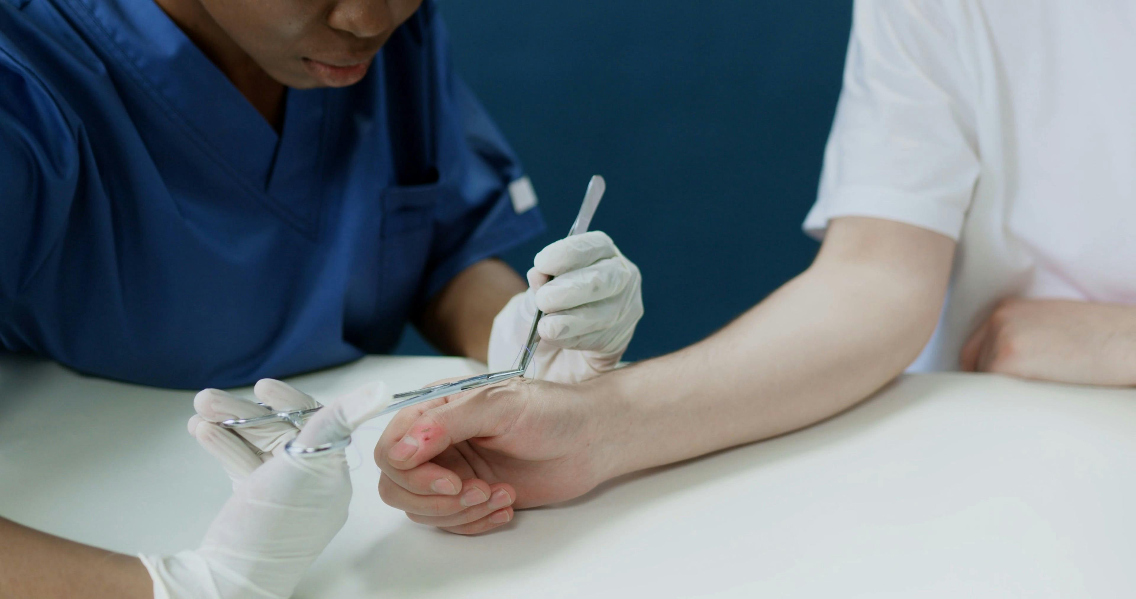 A Medical Professional Suturing the Patient's Wound Free Stock Video ...