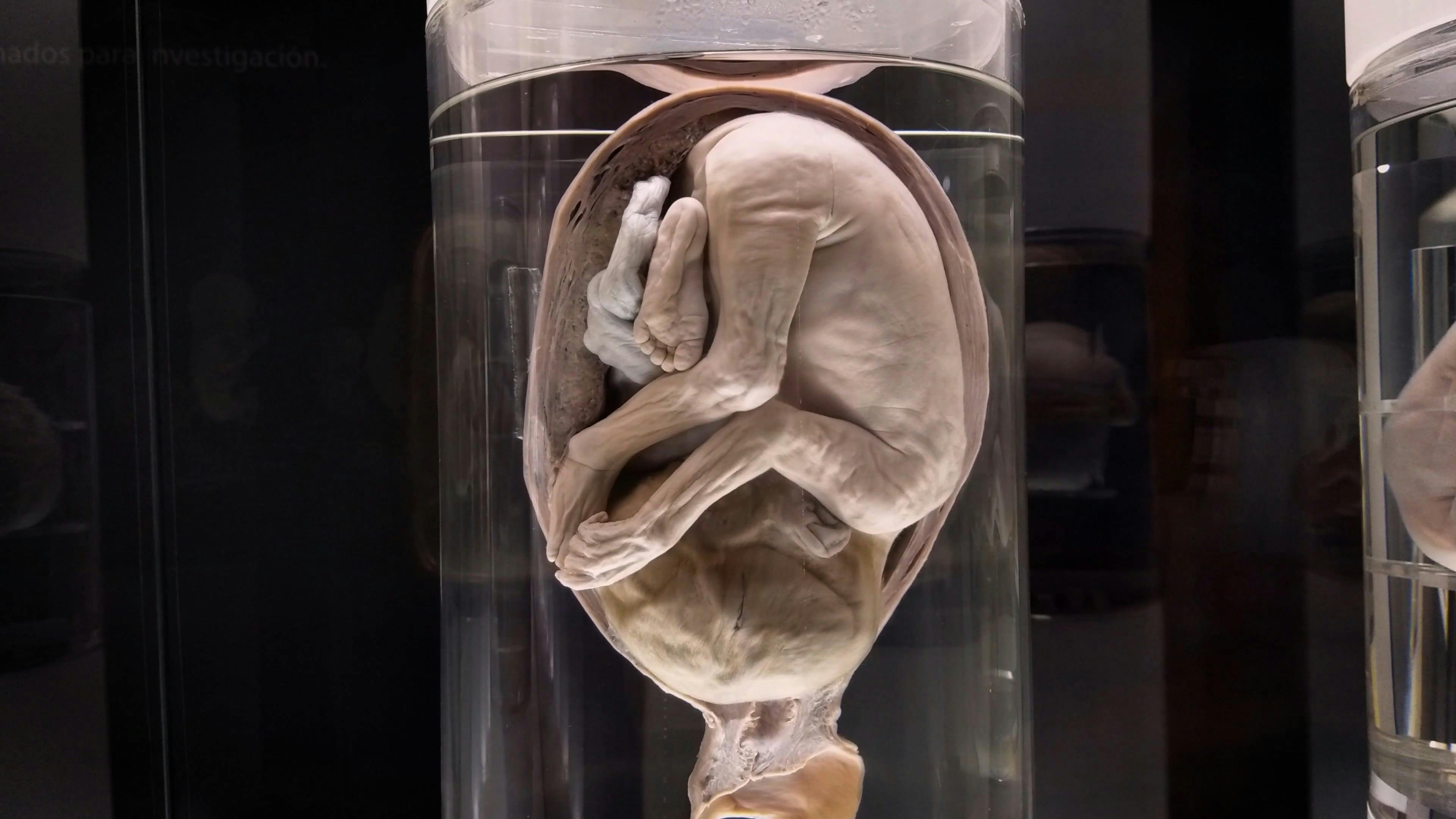 Fetus in Womb Preserved in Formalin Solution Free Stock Video Footage ...
