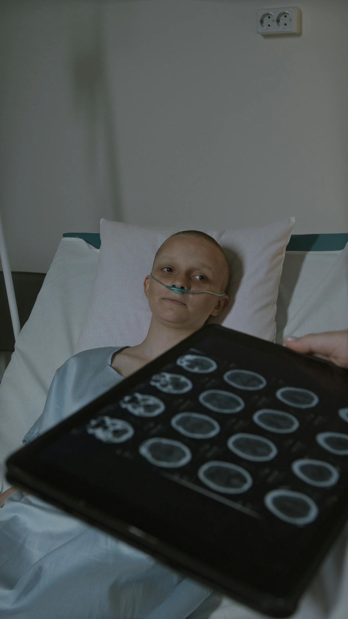 有关ct扫描 Mri X光 X射线 X射线图像 健康 傷 医学影像 医疗保健和医学 医疗扫描仪 專門知識 成像 手