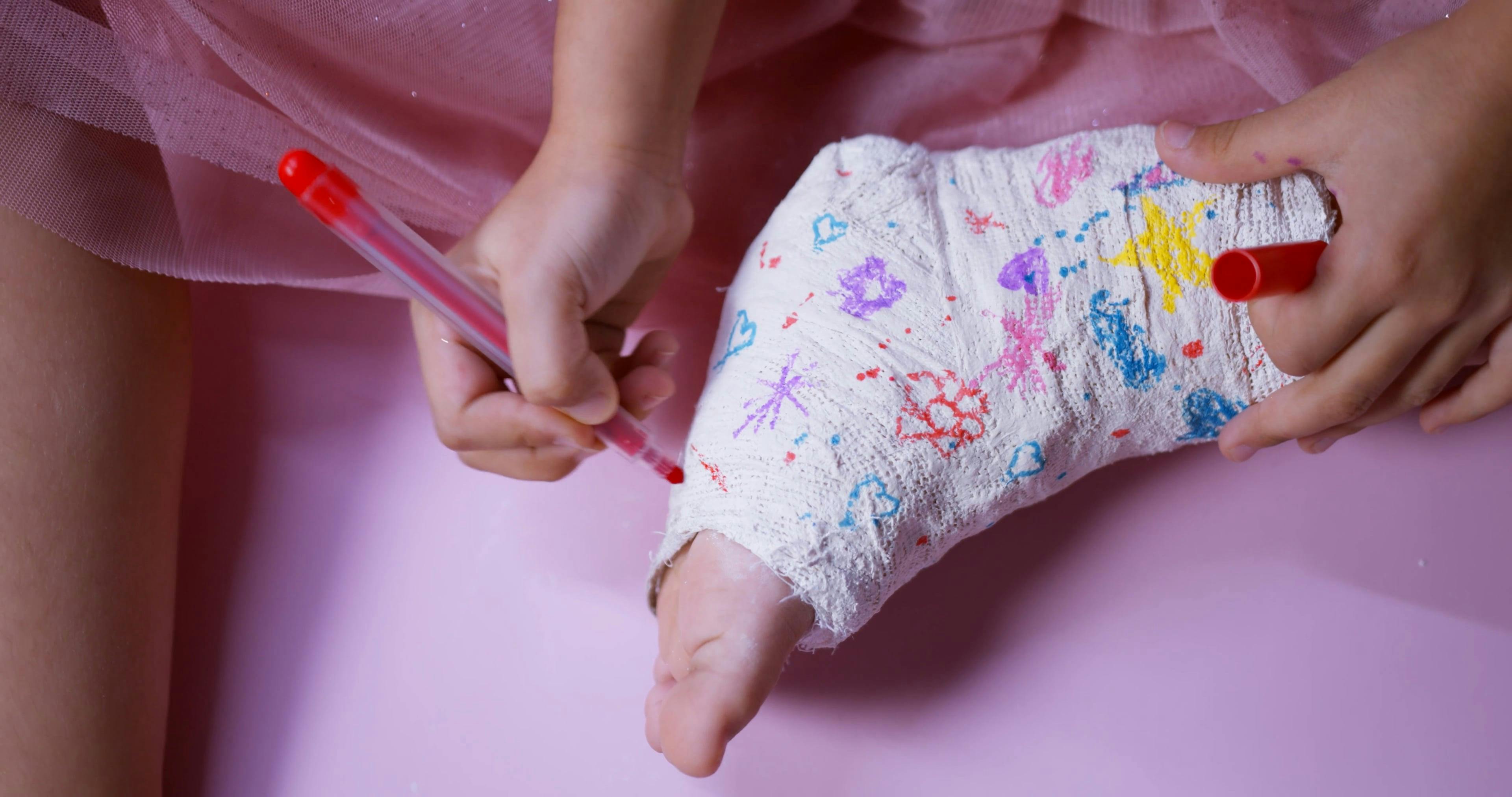 A Little Girl Putting Design on Her Orthopedic Cast Free Stock Video ...