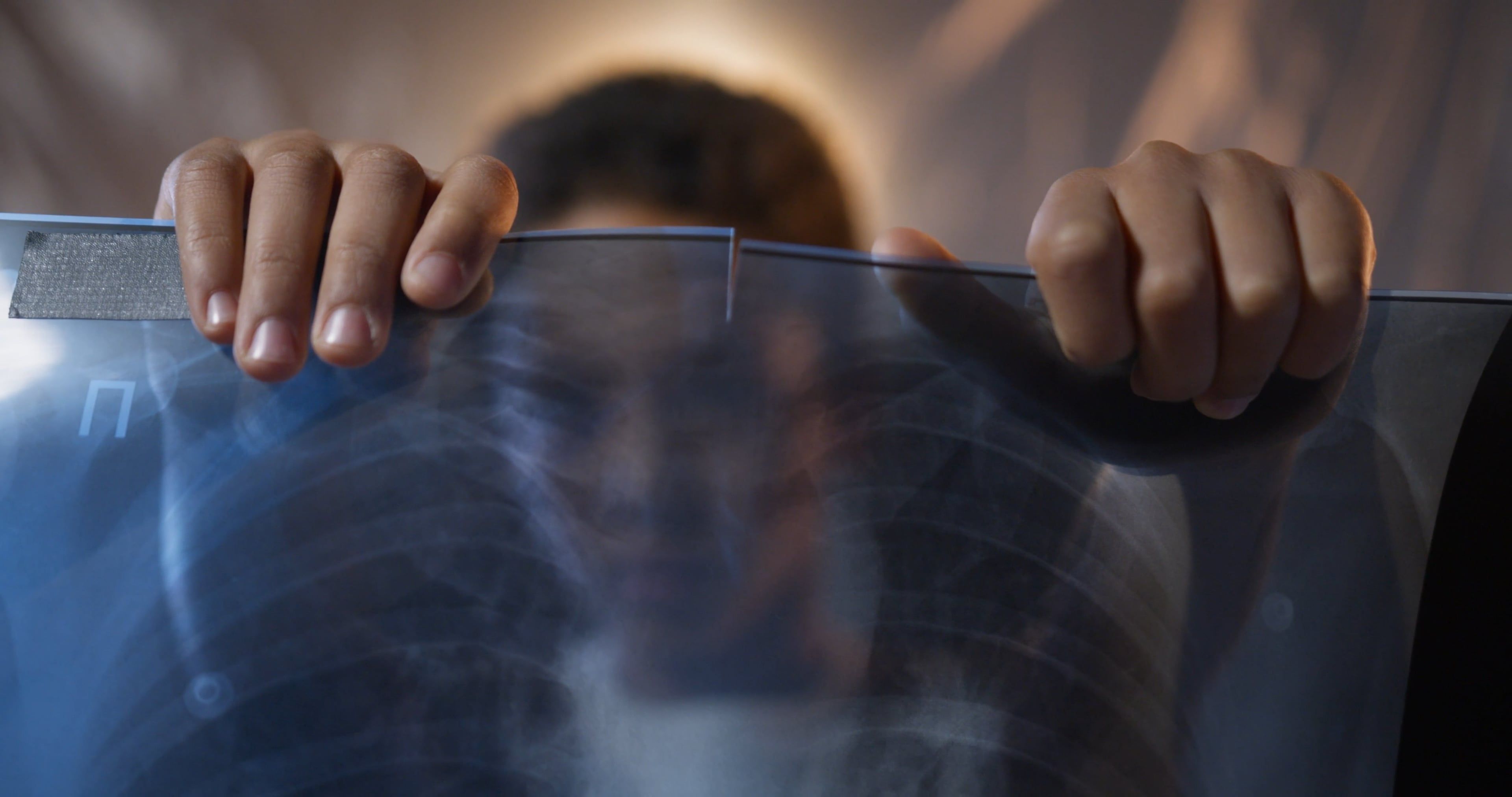 Static Anatomy Videos, Download The BEST Free 4k Stock Video Footage ...