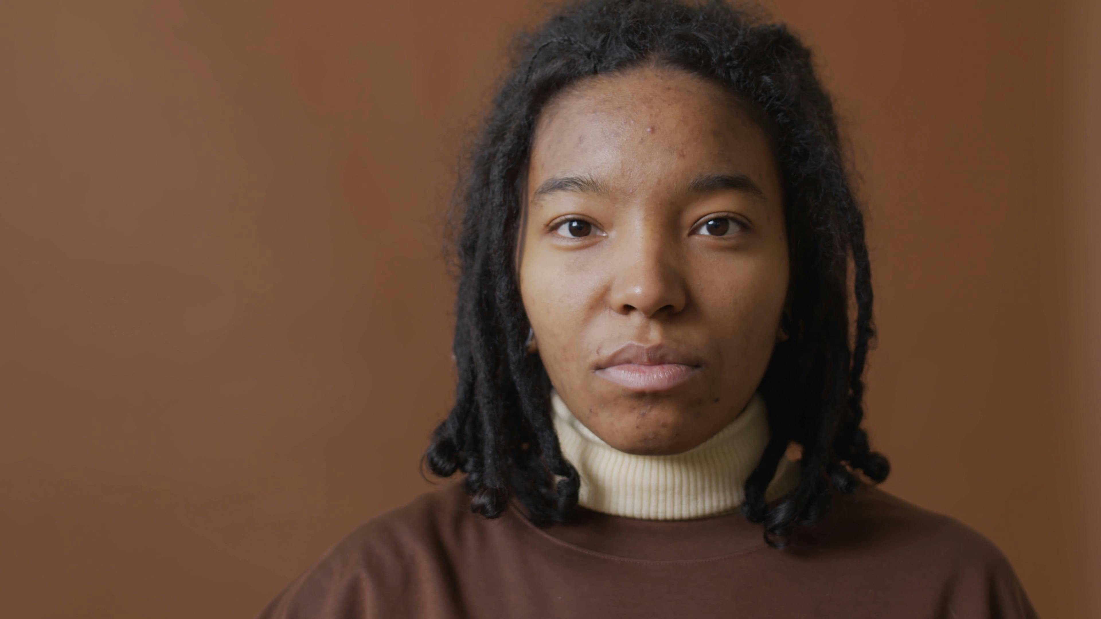 Acne Face Picture Videos, Download The BEST Free 4k Stock Video Footage ...