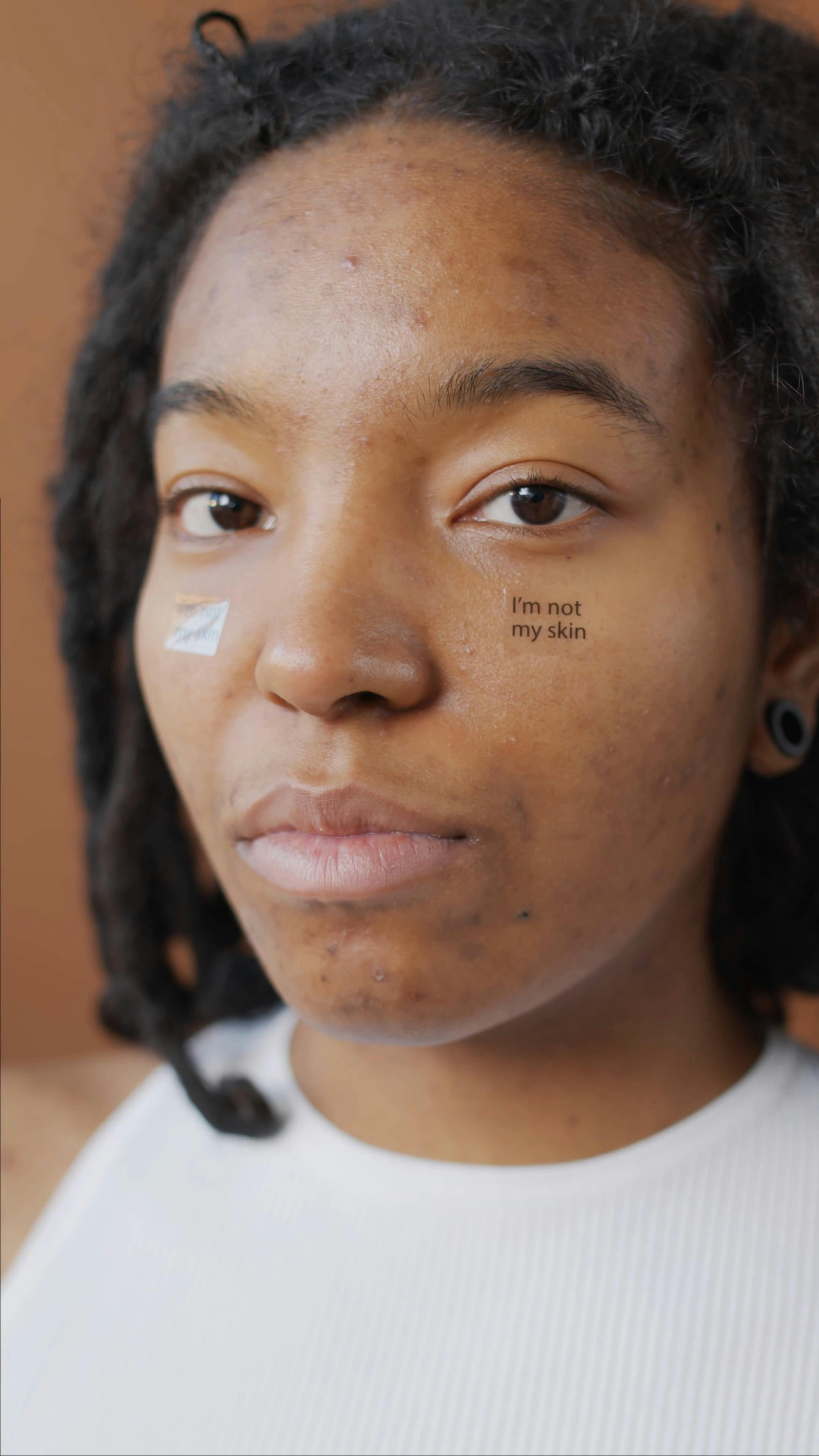 Extreme Close-Up Video of an Acne Free Stock Video Footage, Royalty ...