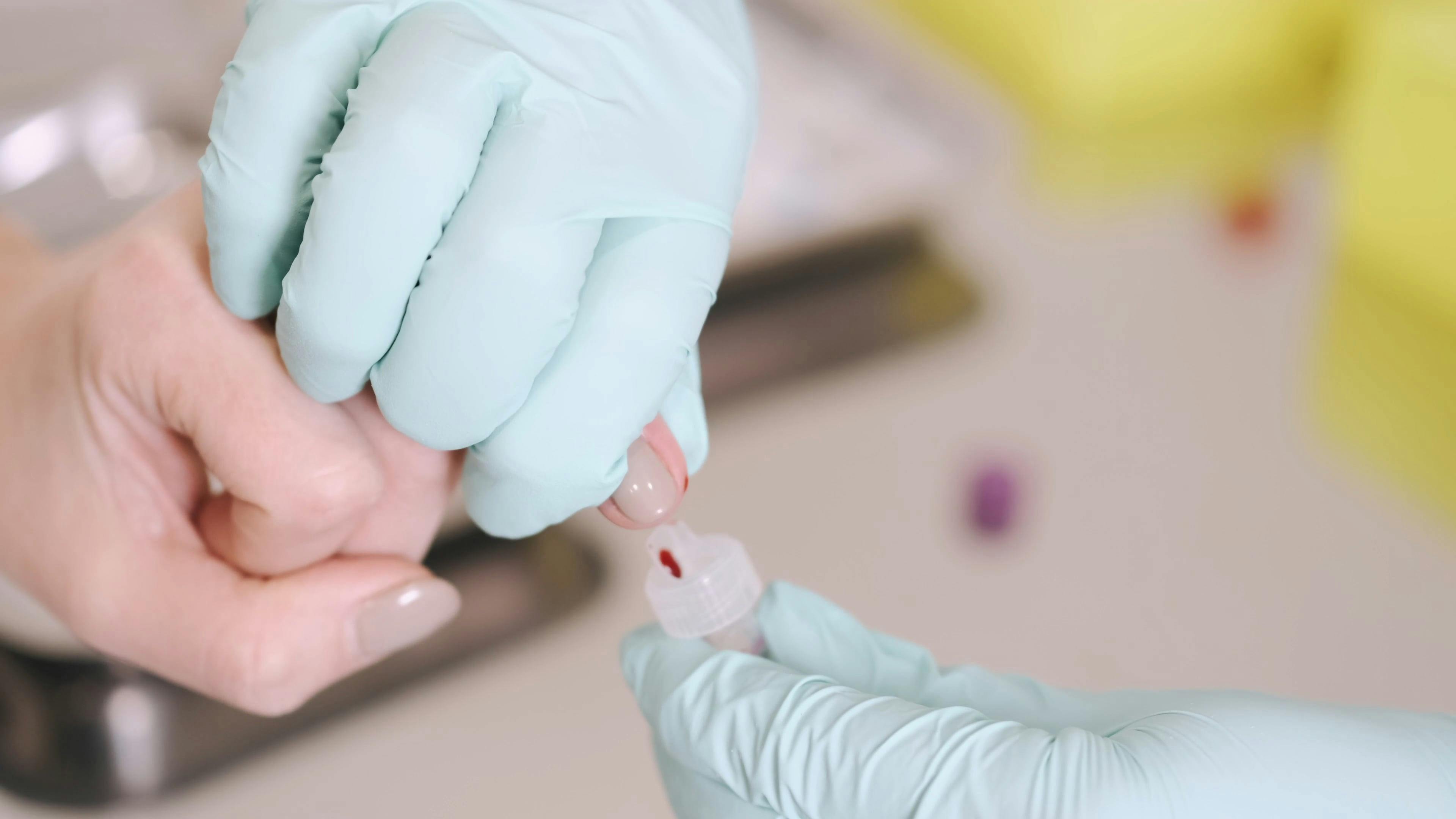 Blood Sample Collection Videos, Download The BEST Free 4k Stock Video ...