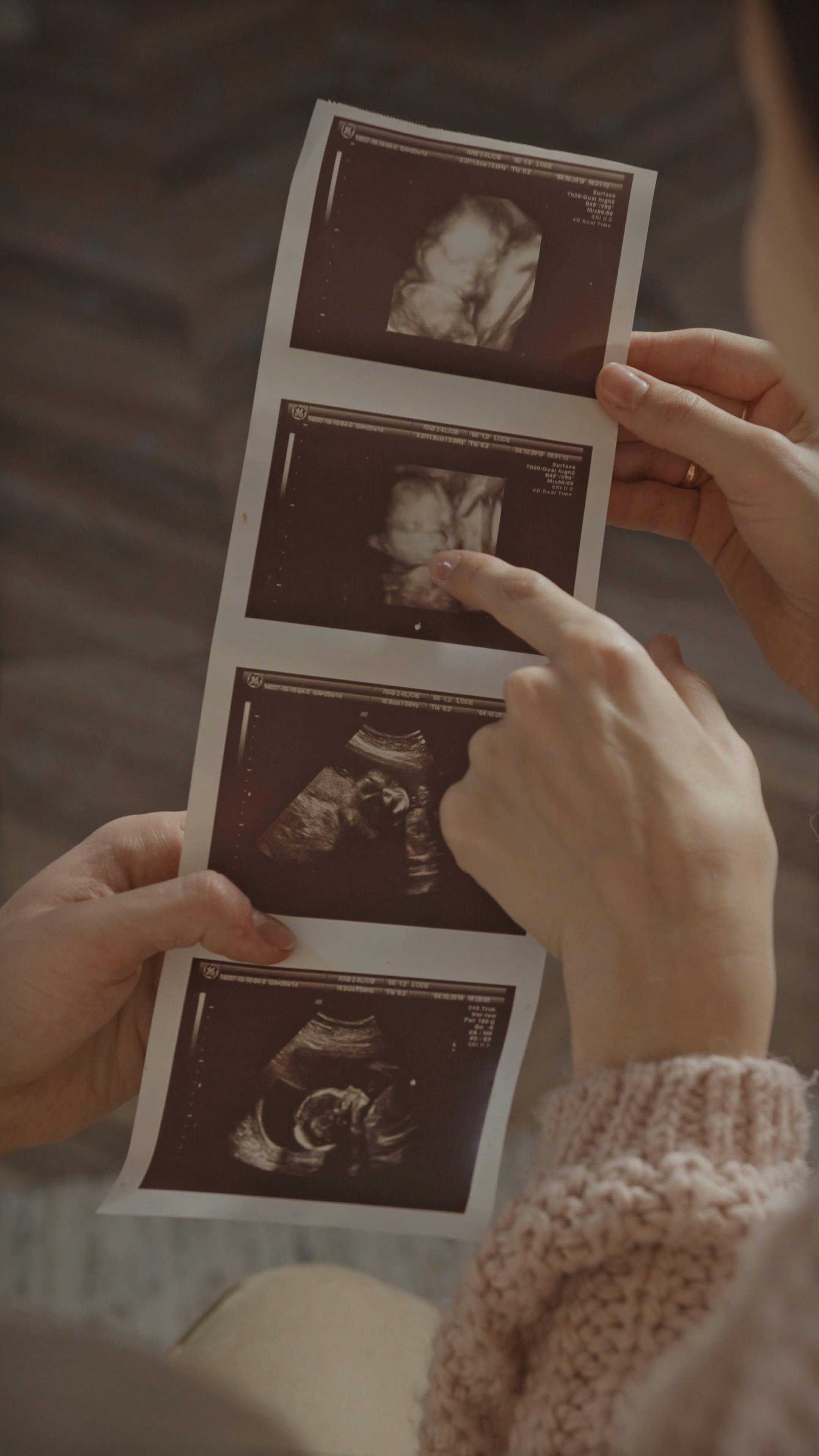 Ultrasound Scan Videos, Download The BEST Free 4k Stock Video Footage ...