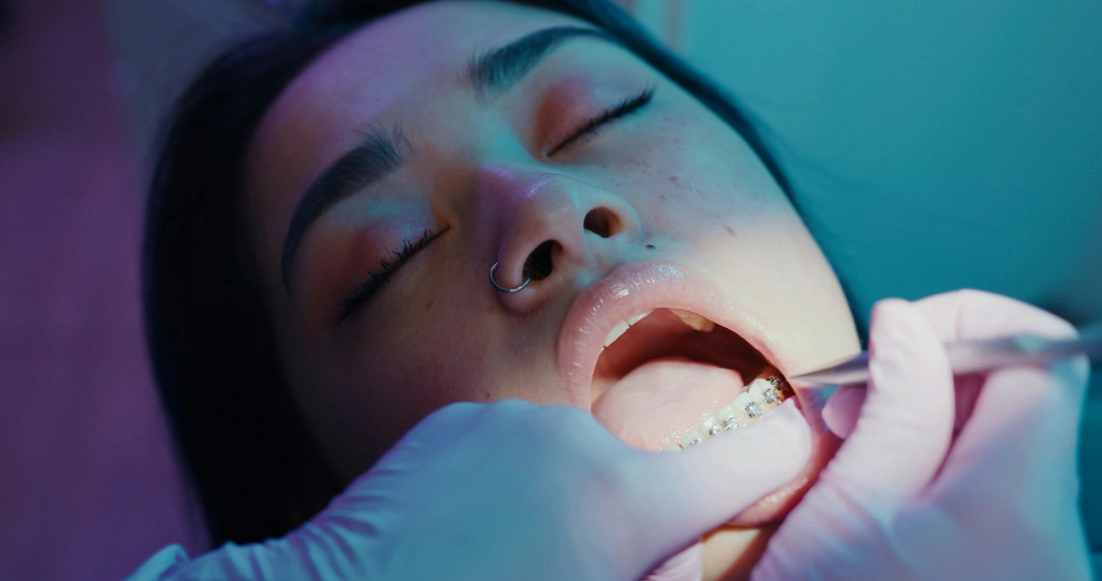 A Woman Having a Dental Check-Up Free Stock Video Footage, Royalty-Free ...