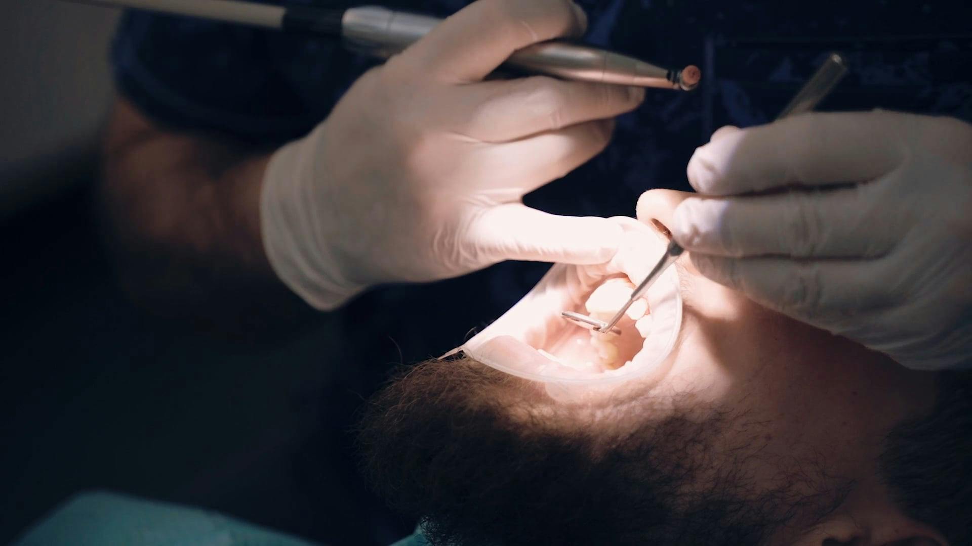 A Man Getting His Teeth Cleaned by a Dentist Free Stock Video Footage ...
